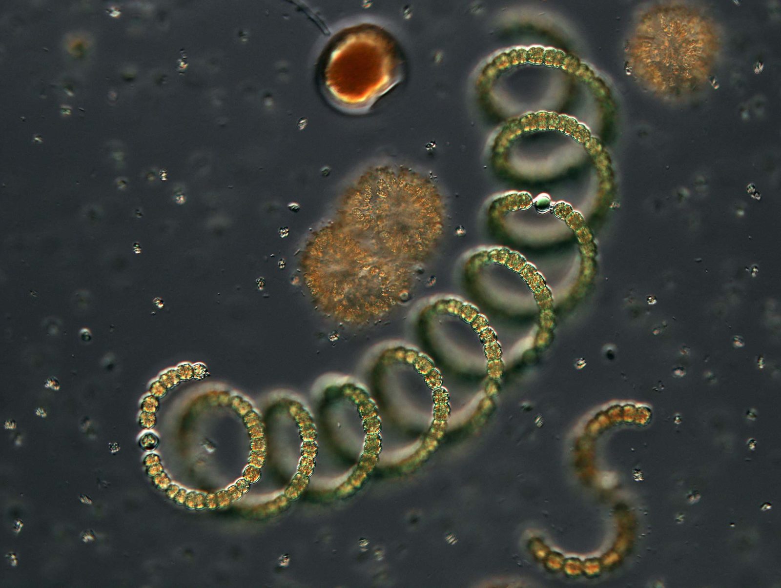 Coiled filamentous cyanobacterium Anabaena sp. | Nikon Small World