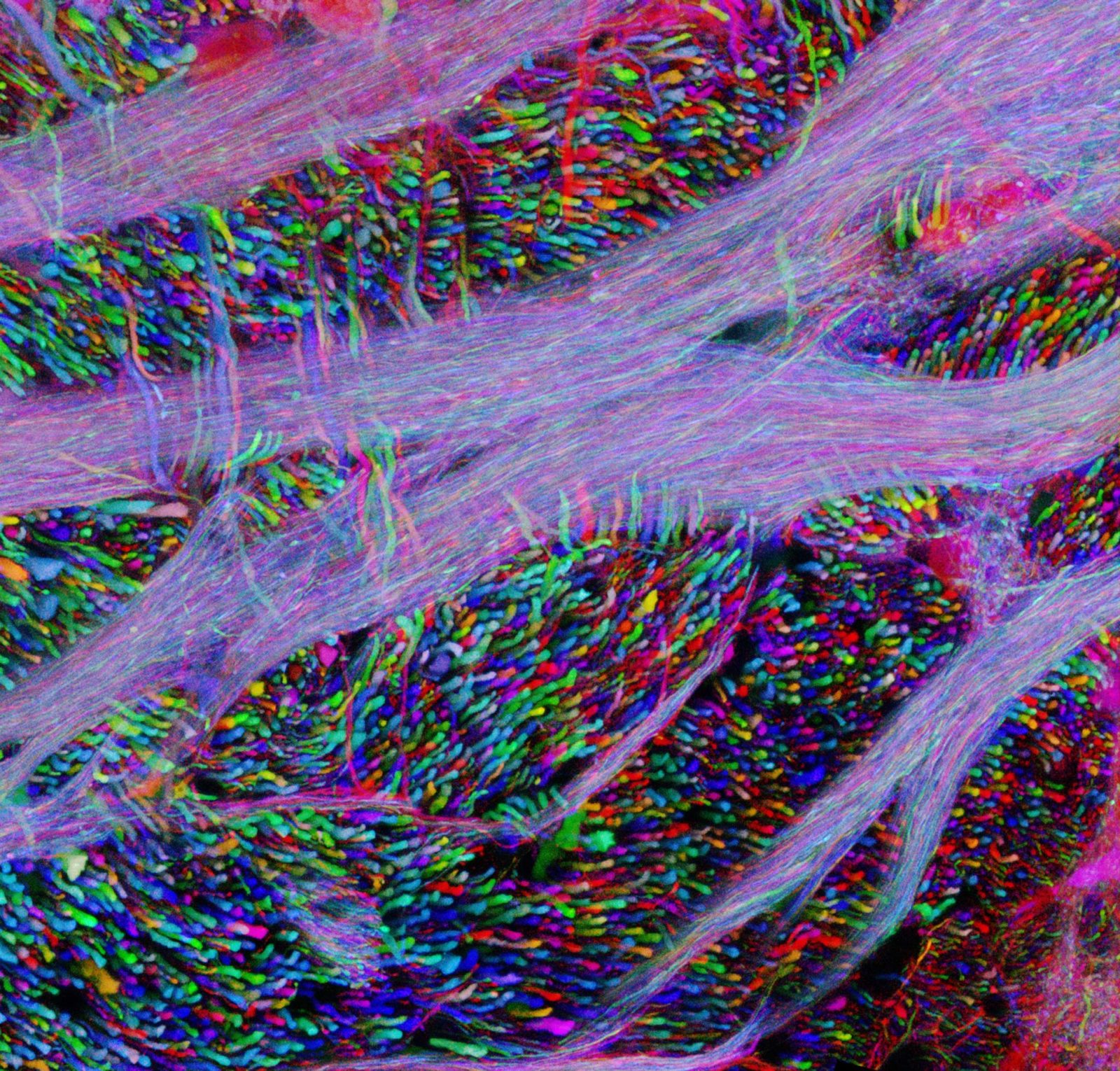 “Brainbow” mouse brain stem with auditory pathway axons | Nikon Small World