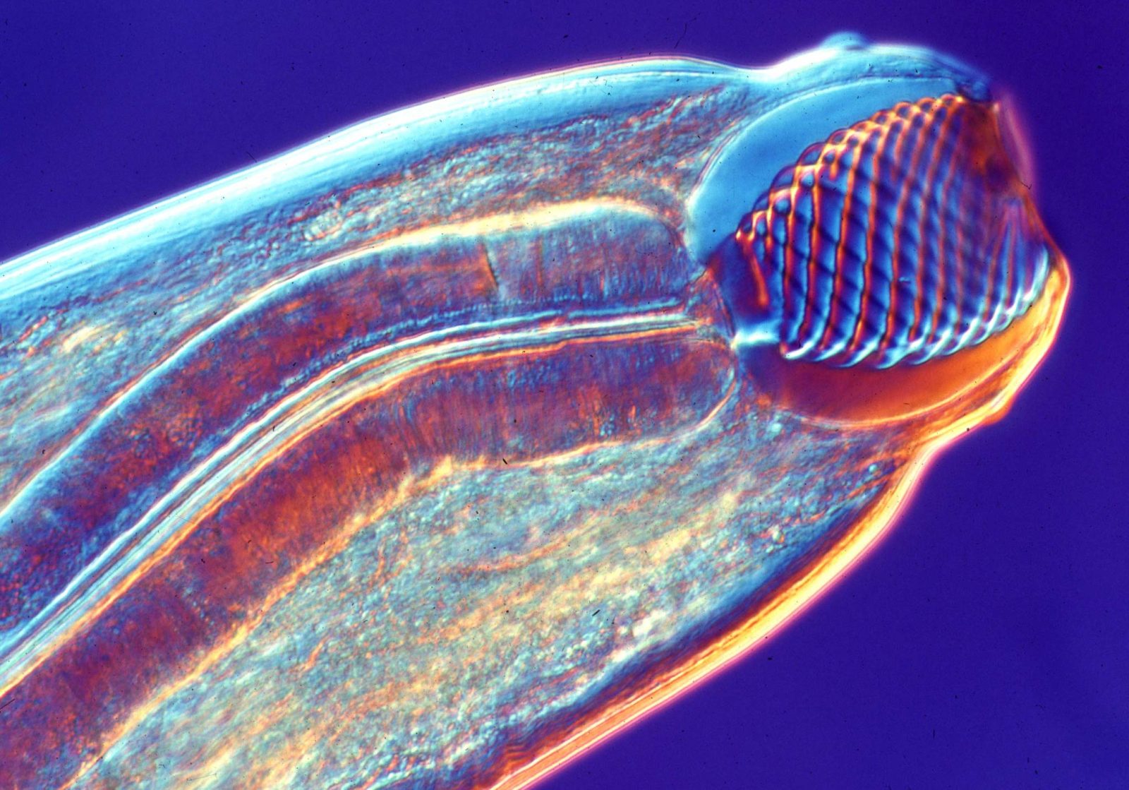 Spirocamallanus sp. nematode | Nikon Small World