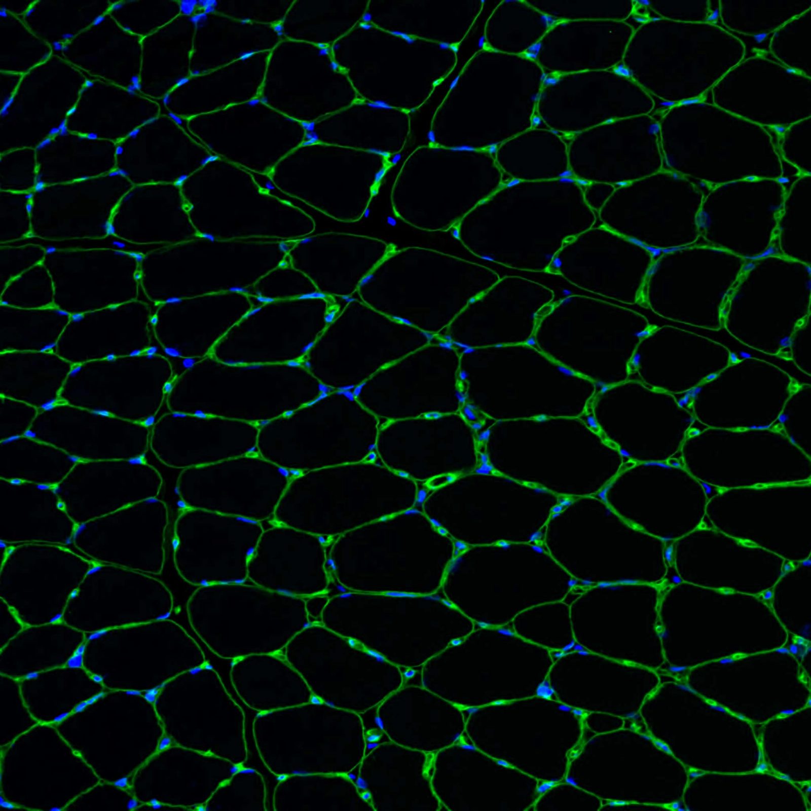 Section of dog skeletal muscle, immunolabeling of laminin (green ...