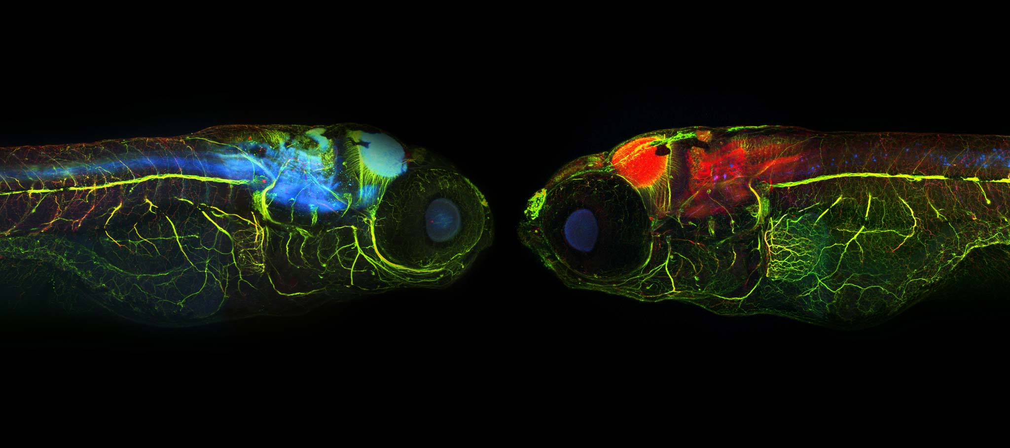 Alzheimer Zebrafish, stained for Tau (red), neurons (green), synapses ...