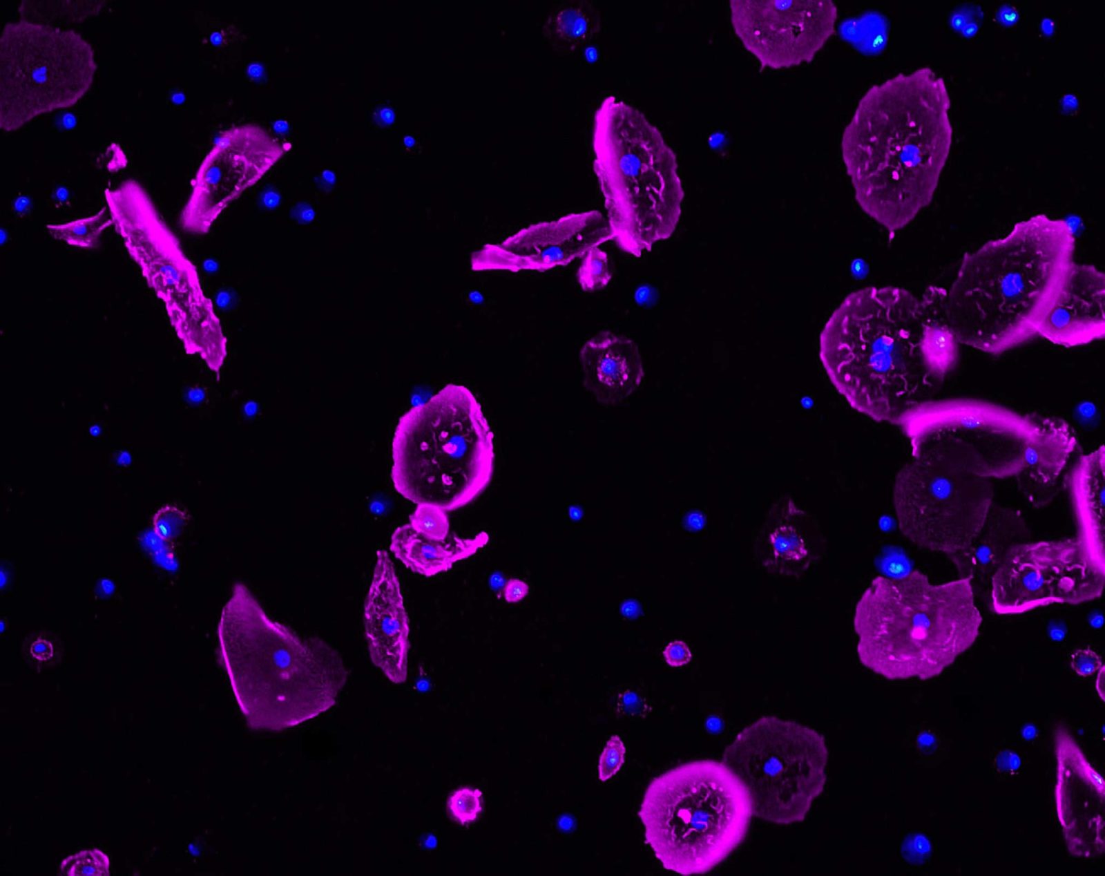 Drosophila melanogaster immune cells | Nikon Small World