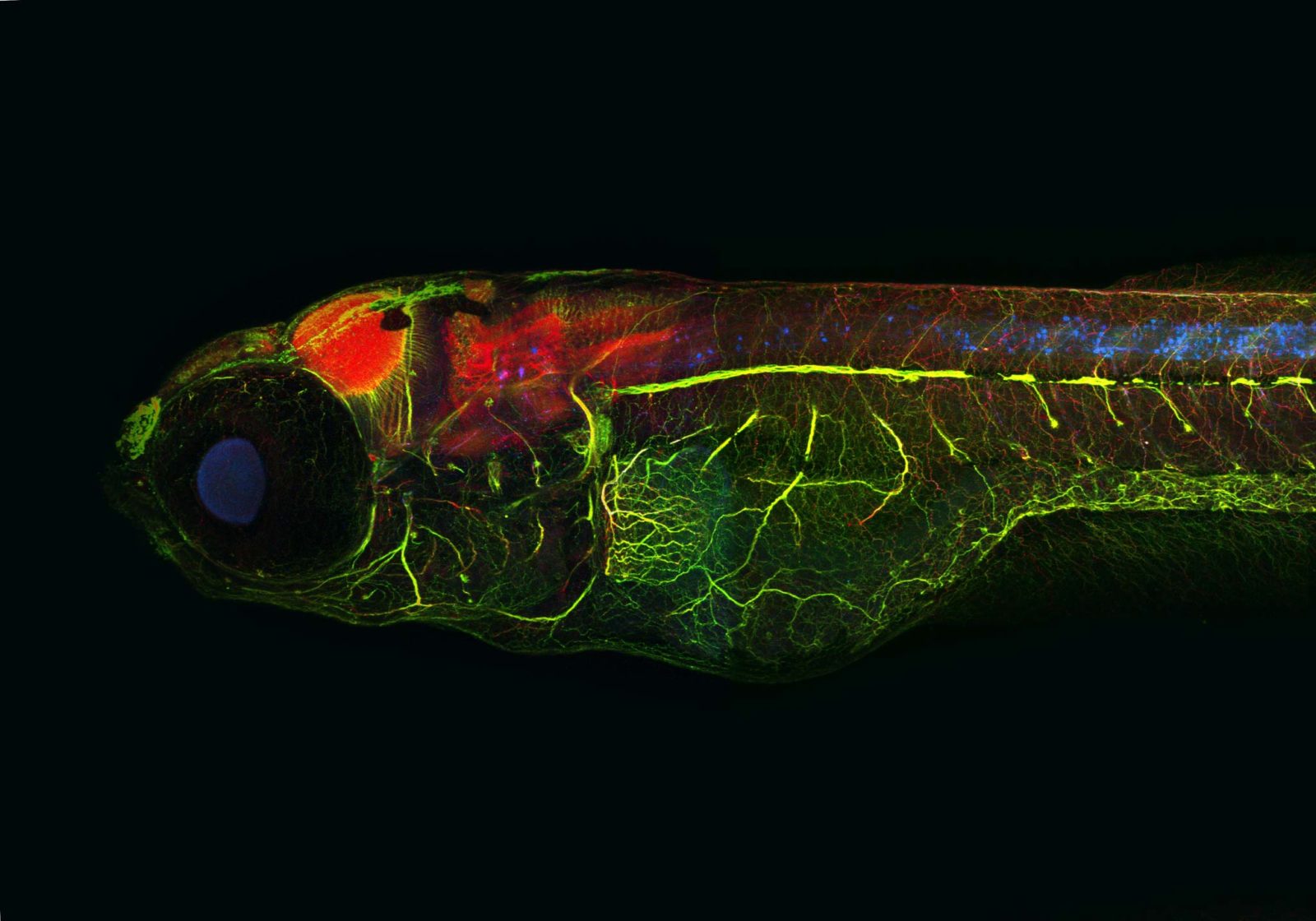 “Alzheimer” Zebrafish, stained for Tau (red), neurons (green), and ...