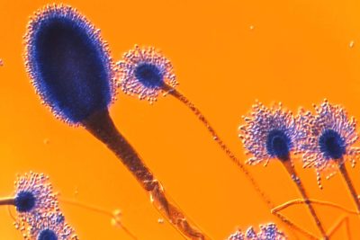 Aspergillus sp. | Nikon Small World