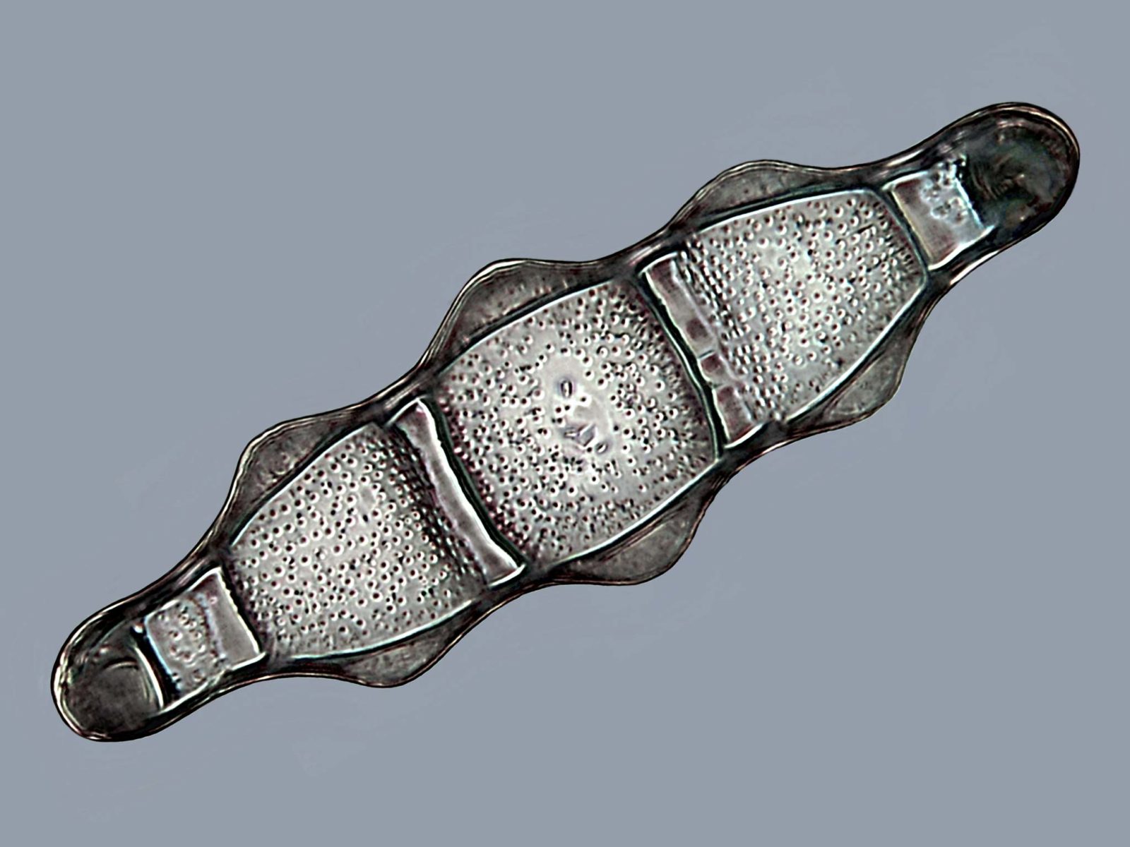 Biddulphia capucina (diatom) | Nikon Small World