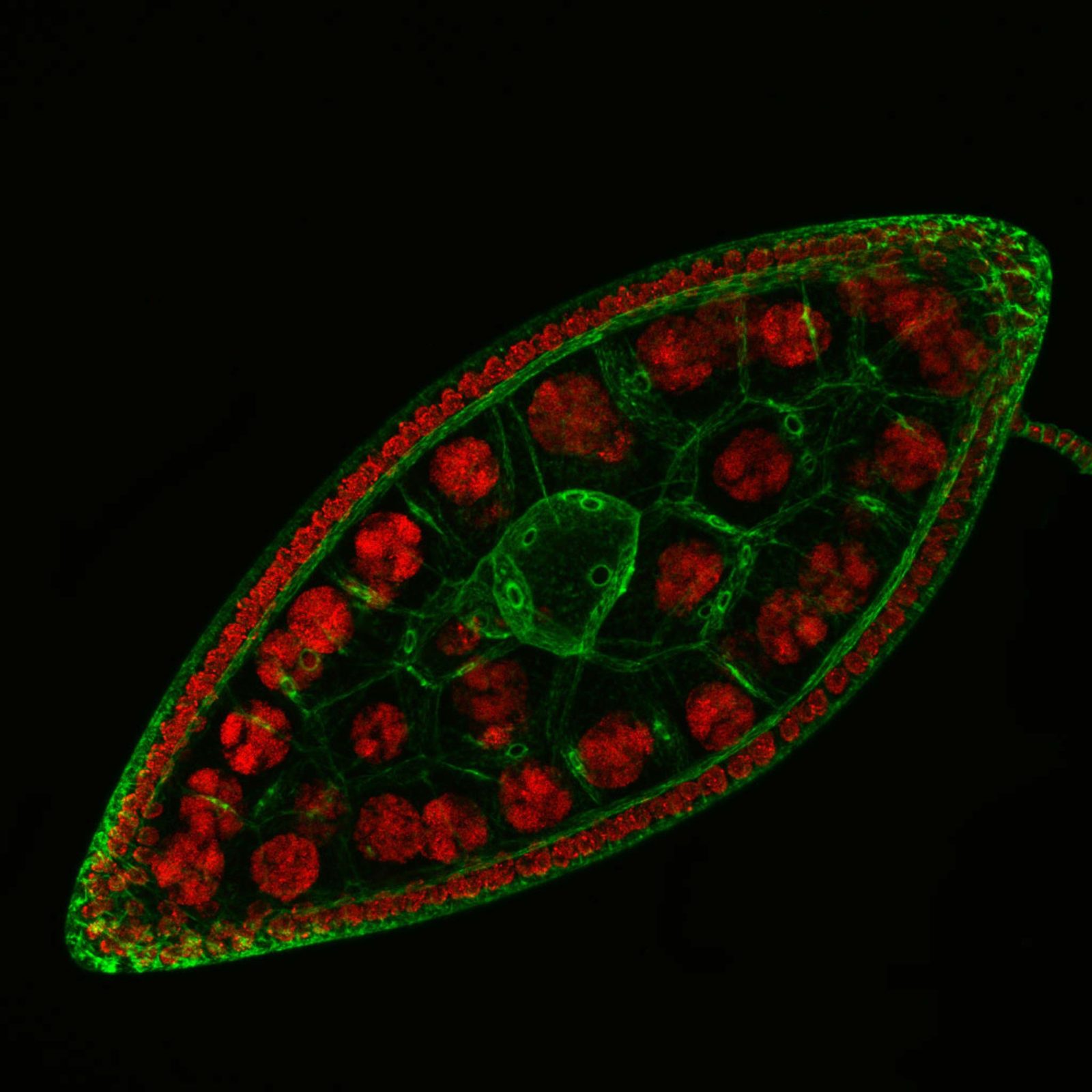 Drosophila sp. (fly) egg chamber with extra cell number | Nikon Small World