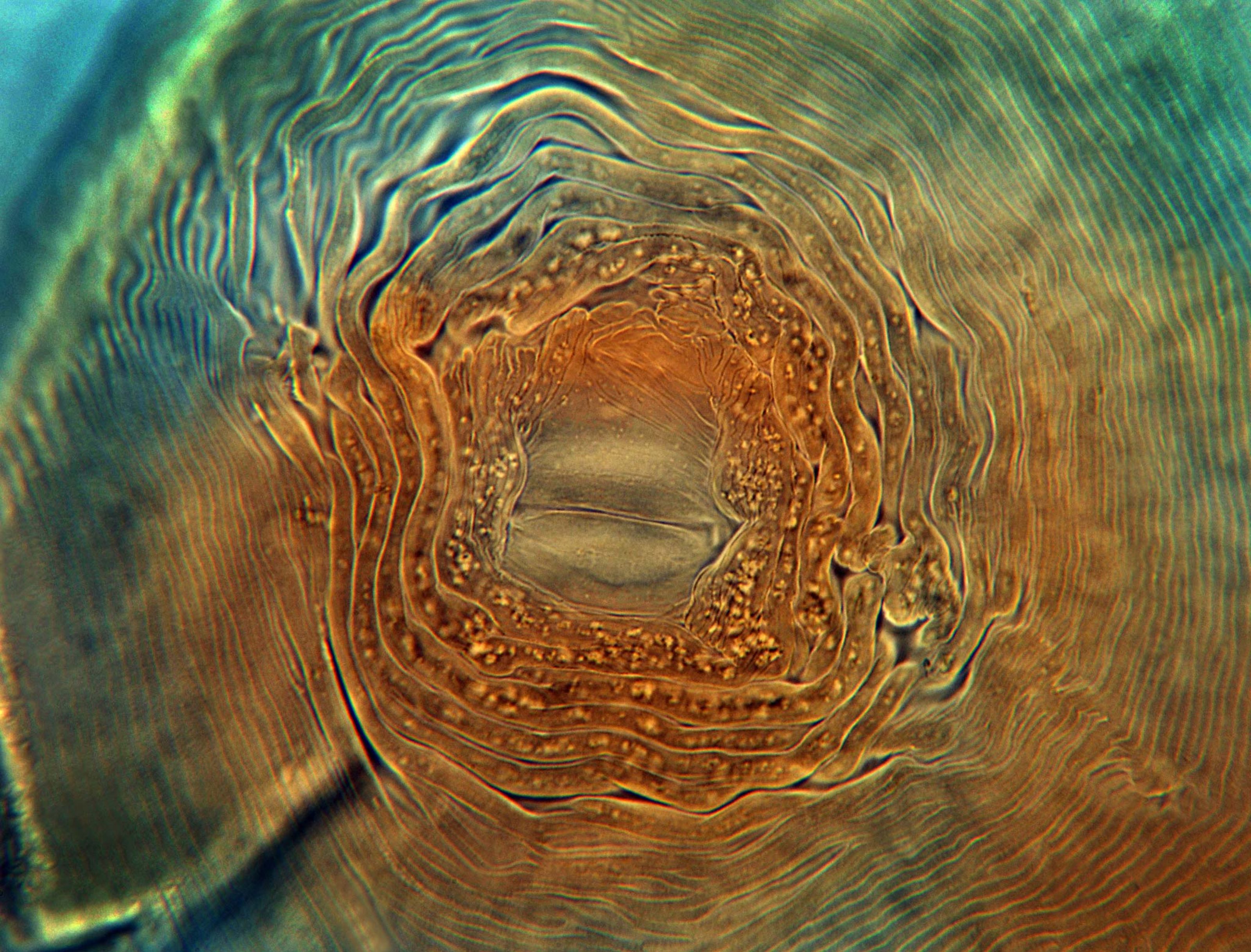 Meloidogyne camelliae (root-knot nematode) perineal pattern | Nikon ...