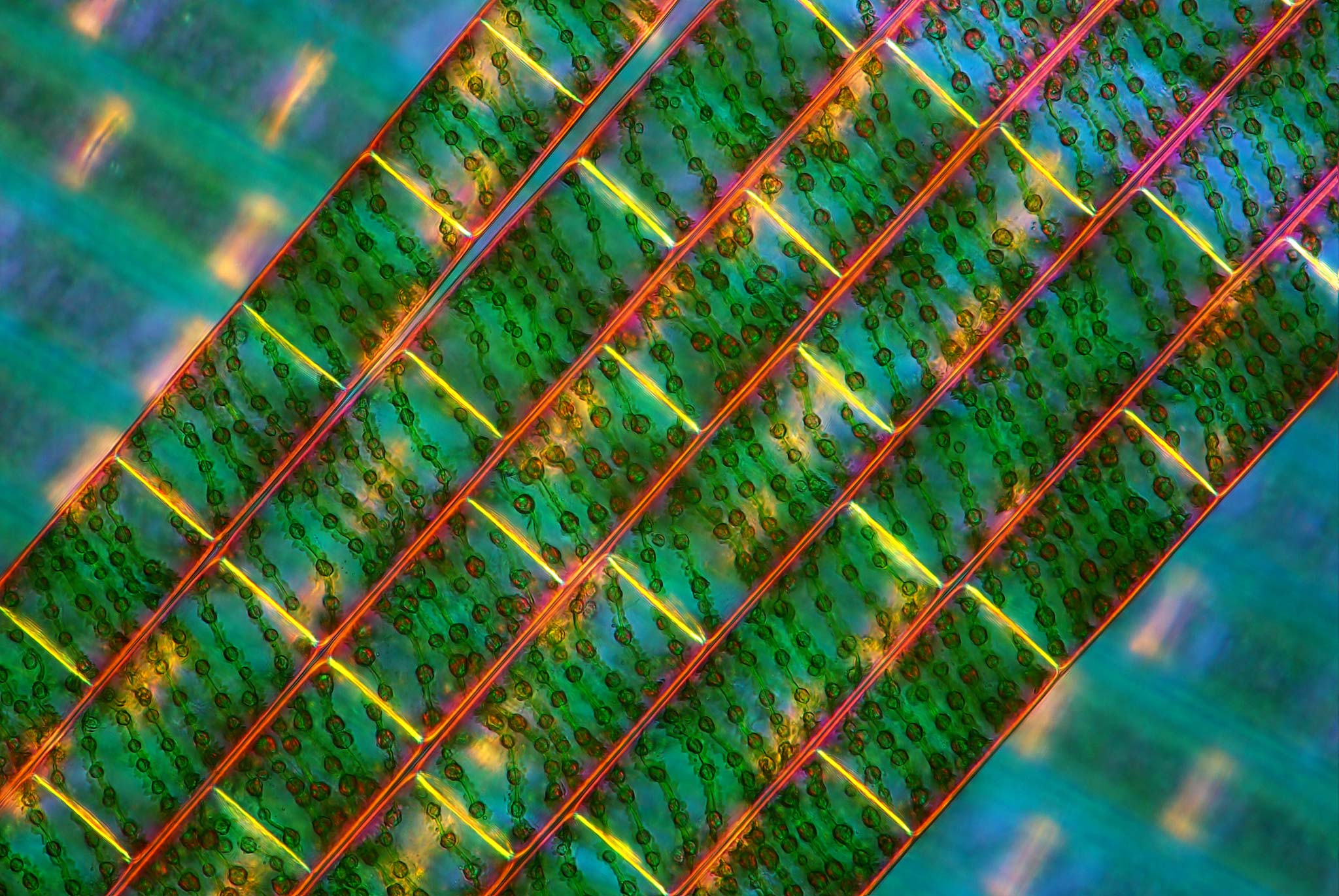 Spirogyra sp. (green algae) filaments | Nikon Small World