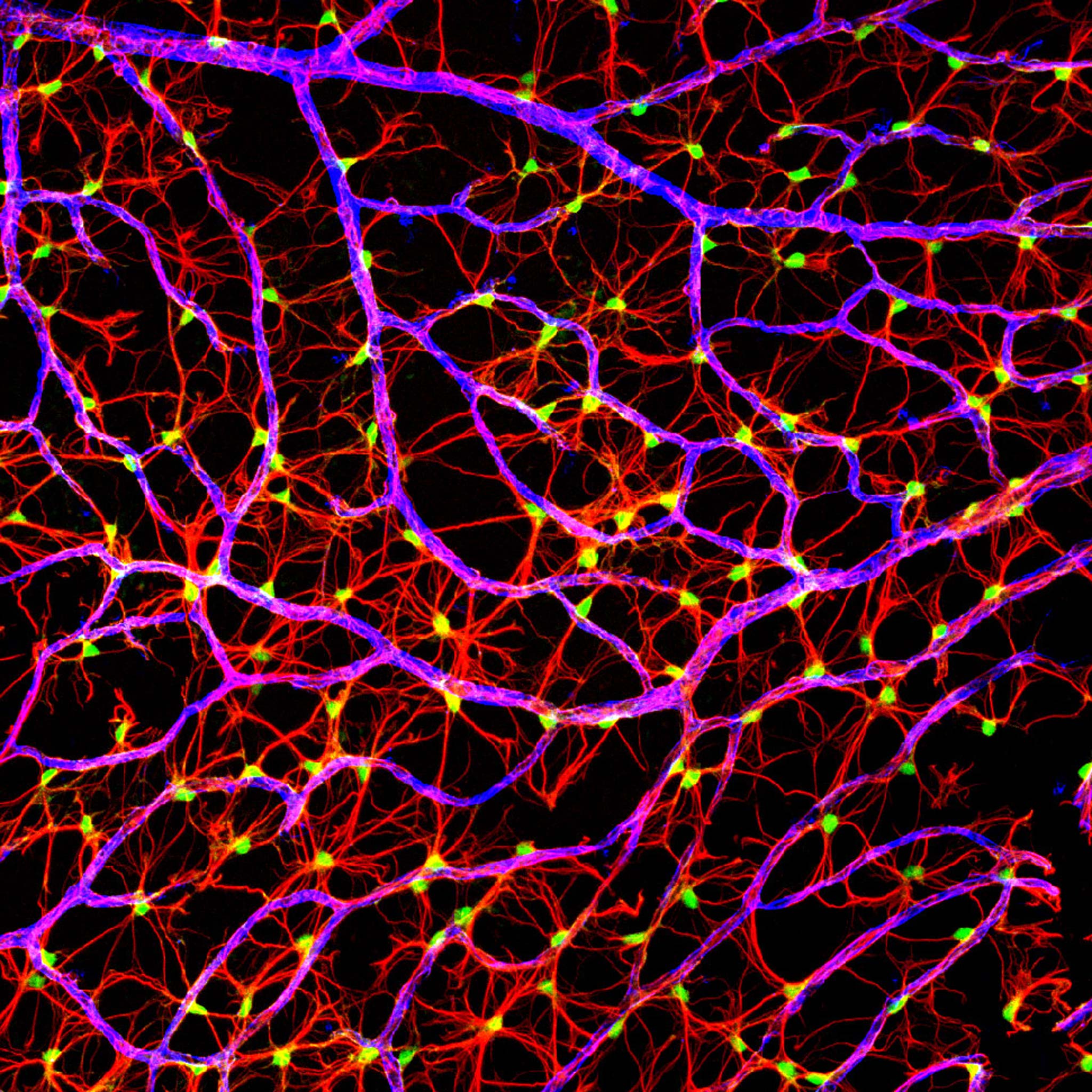 Retinal flatmount of mouse nerve fiber layer | Nikon Small World