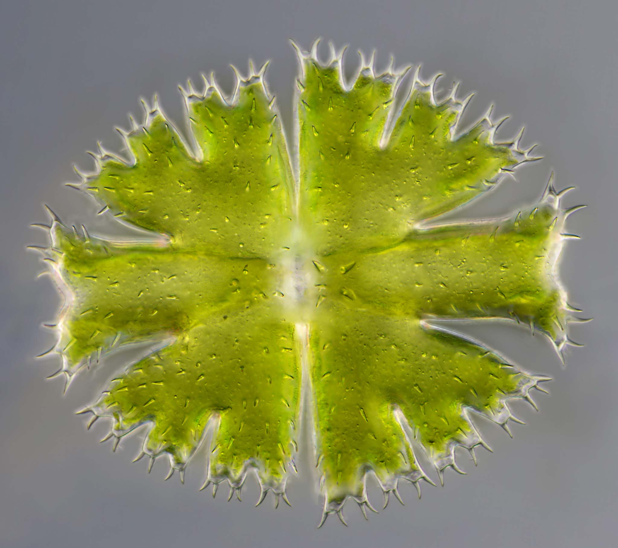 Micrasterias apiculata (green alga) cell wall, living specimen | Nikon ...