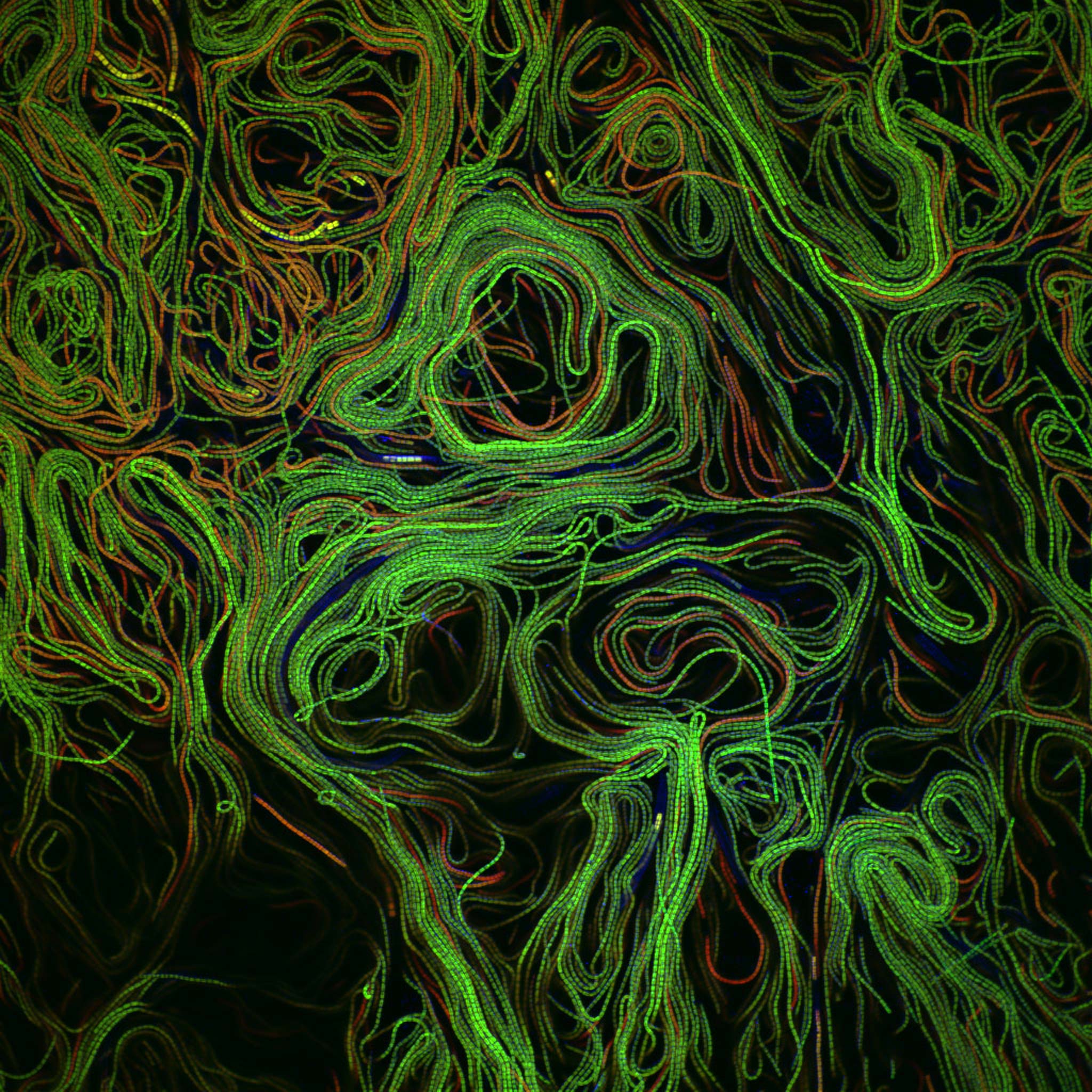 Algae biofilm | Nikon Small World