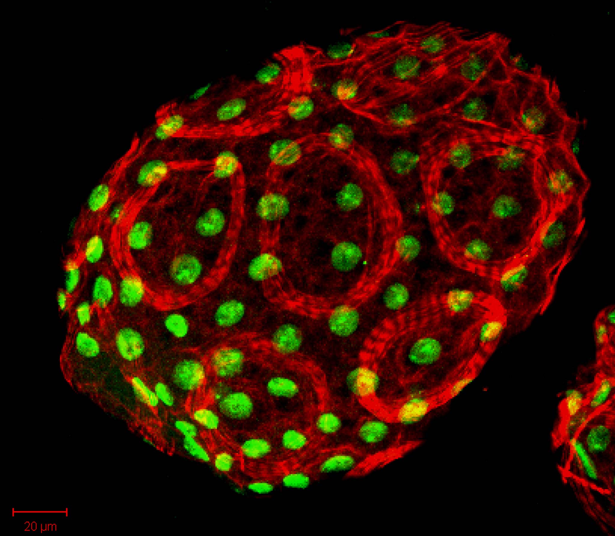 Rhynchosciara americana (fly) oocytes | Nikon Small World