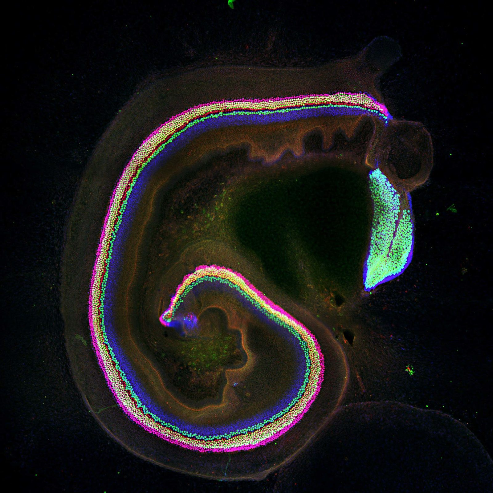 Embryonic day 14 cochlear explant with saccule, cultured 4 days | 2011 ...