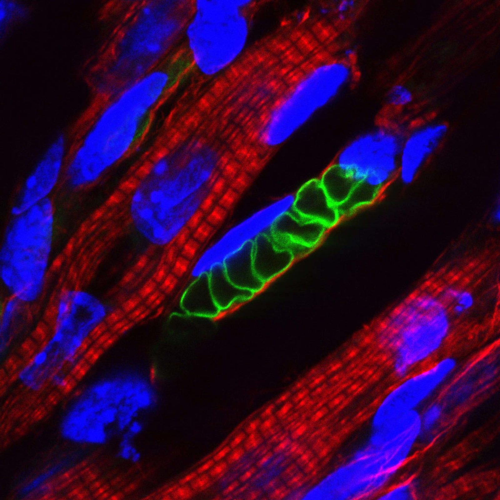 Mouse embryonic skeletal muscle and red blood cells, frozen section ...