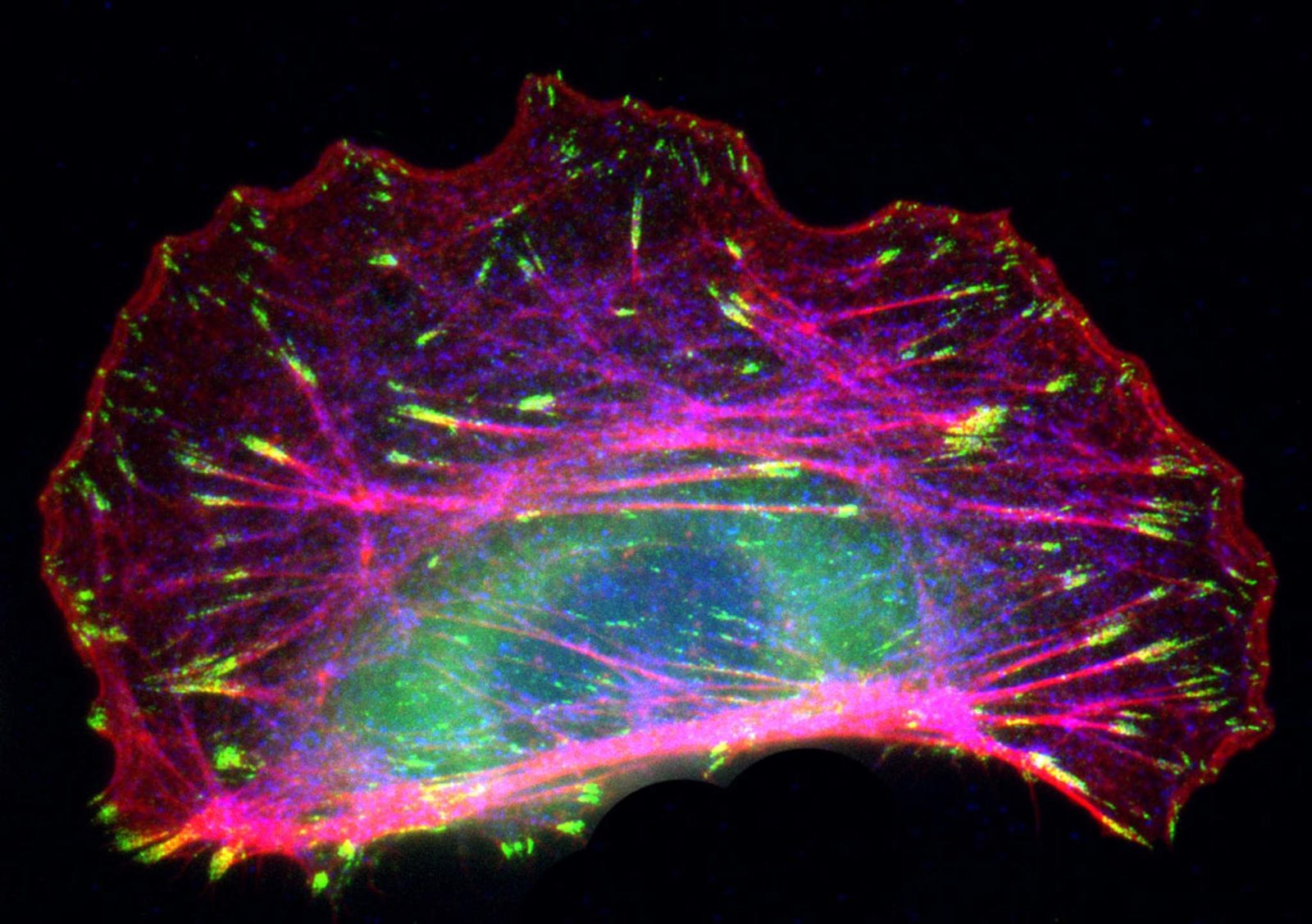 Human Osteosarcoma cells (U2OS) | Nikon Small World
