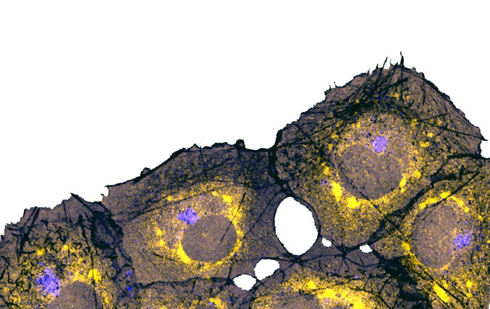 Stressed COS-7 cells | Nikon Small World