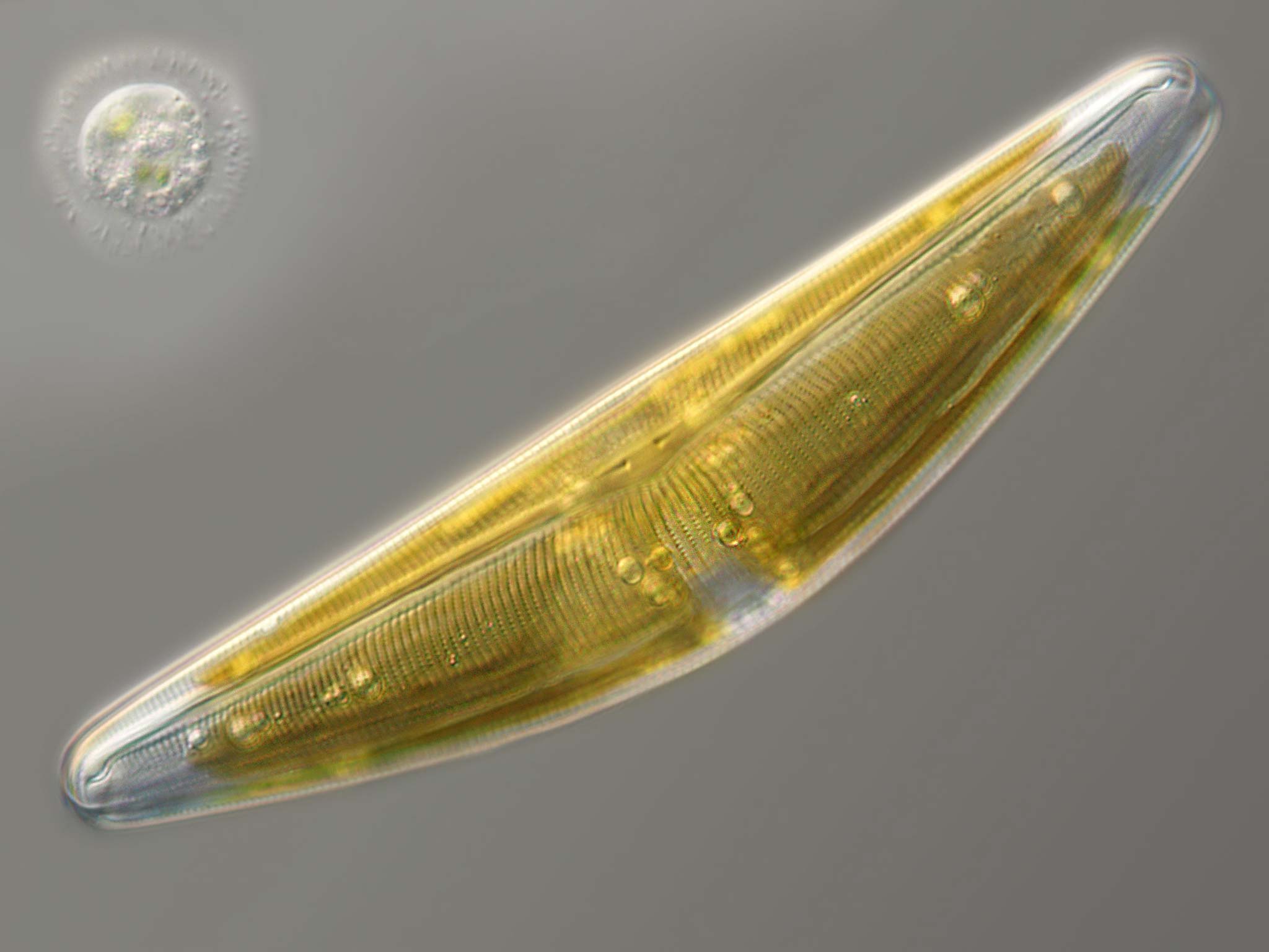 Cymbella (diatom) together with Cochliopodium (amoeba) | Nikon Small World