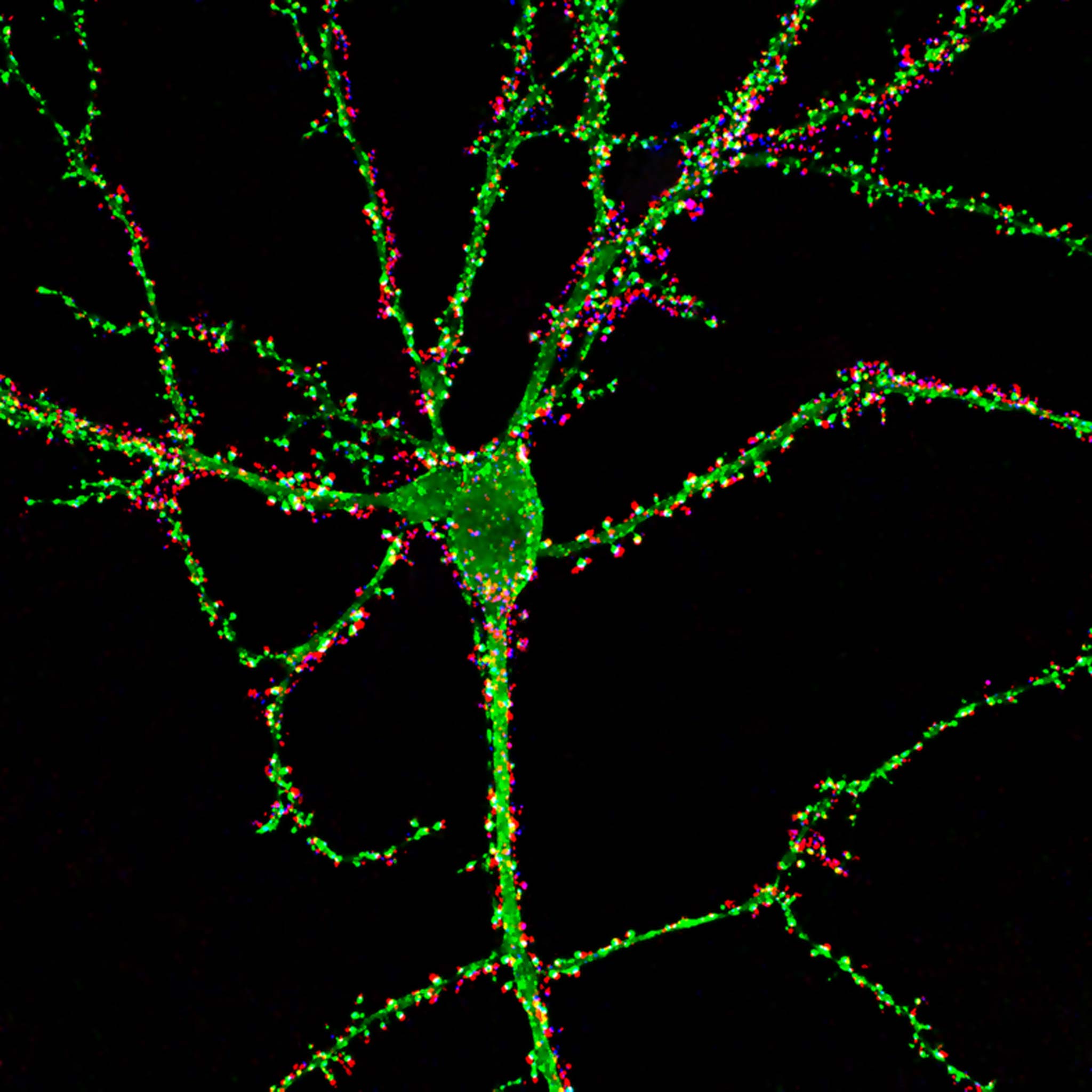Cultured rat hippocampal neuron | Nikon Small World
