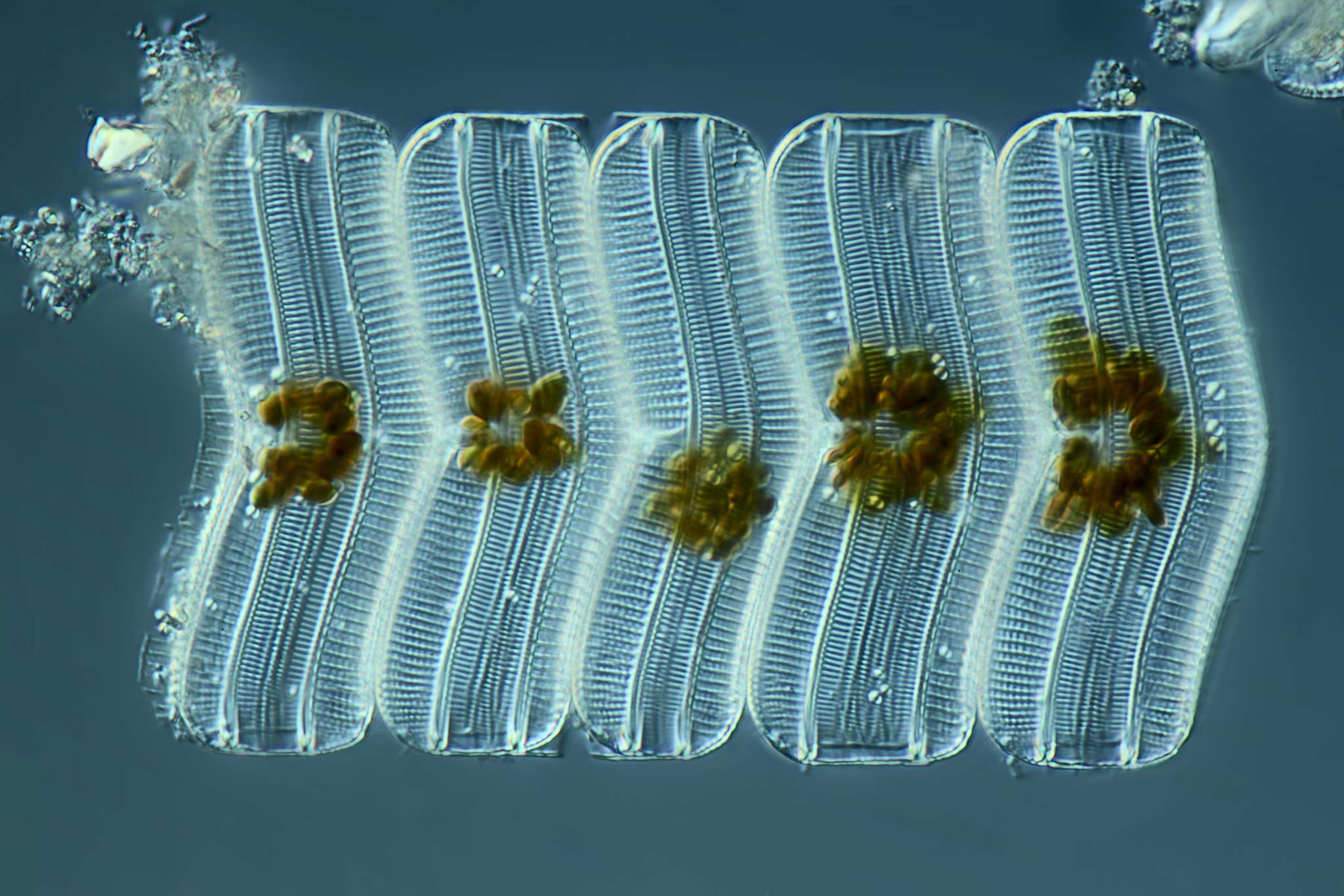 Achnanthes longipes (a diatom, Bacillariophyta) | Nikon Small World