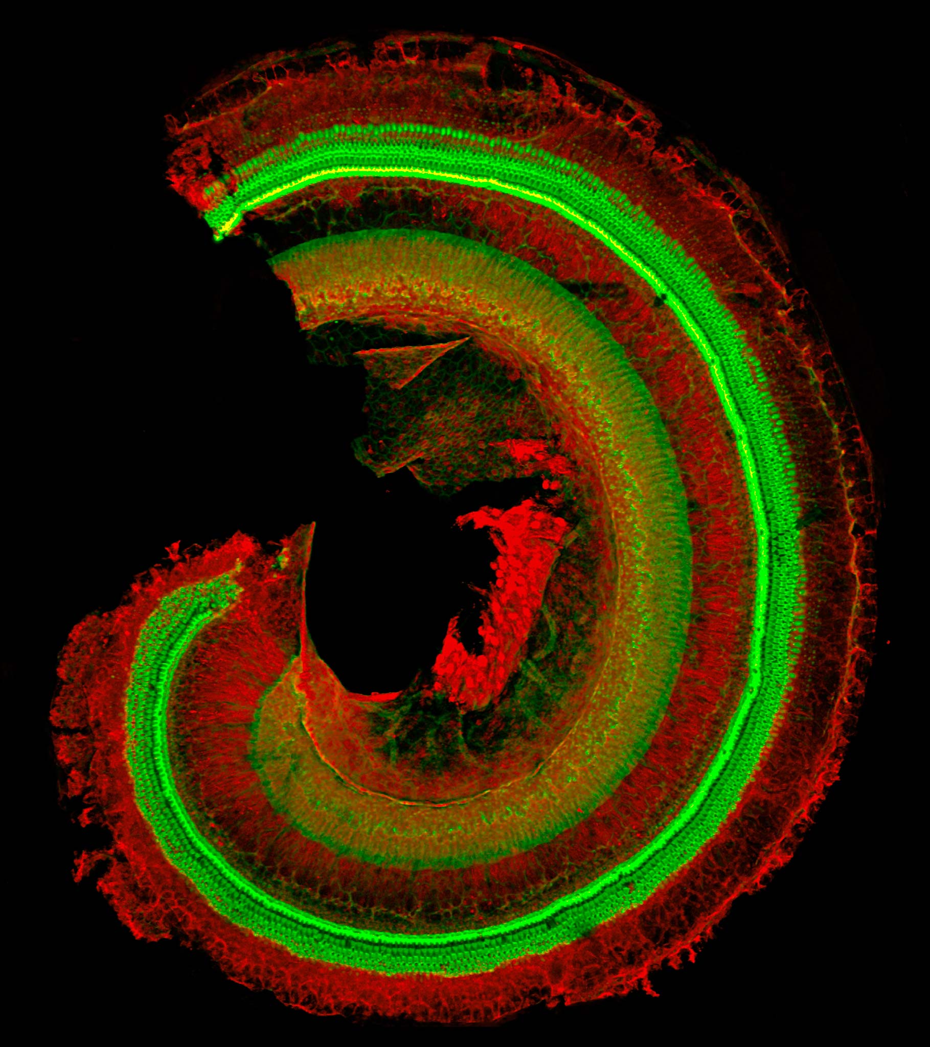 Sound receptor “hair cells” (bright green) in the inner ear cochlea of ...