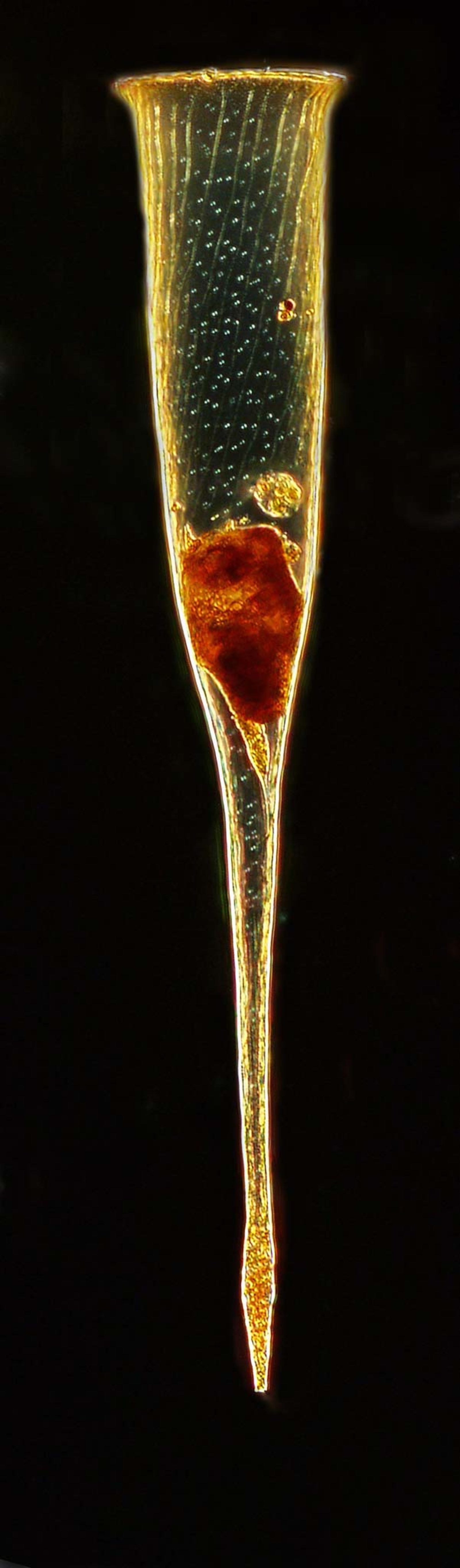 Rhabdonella spiralis (marine ciliate) | Nikon Small World