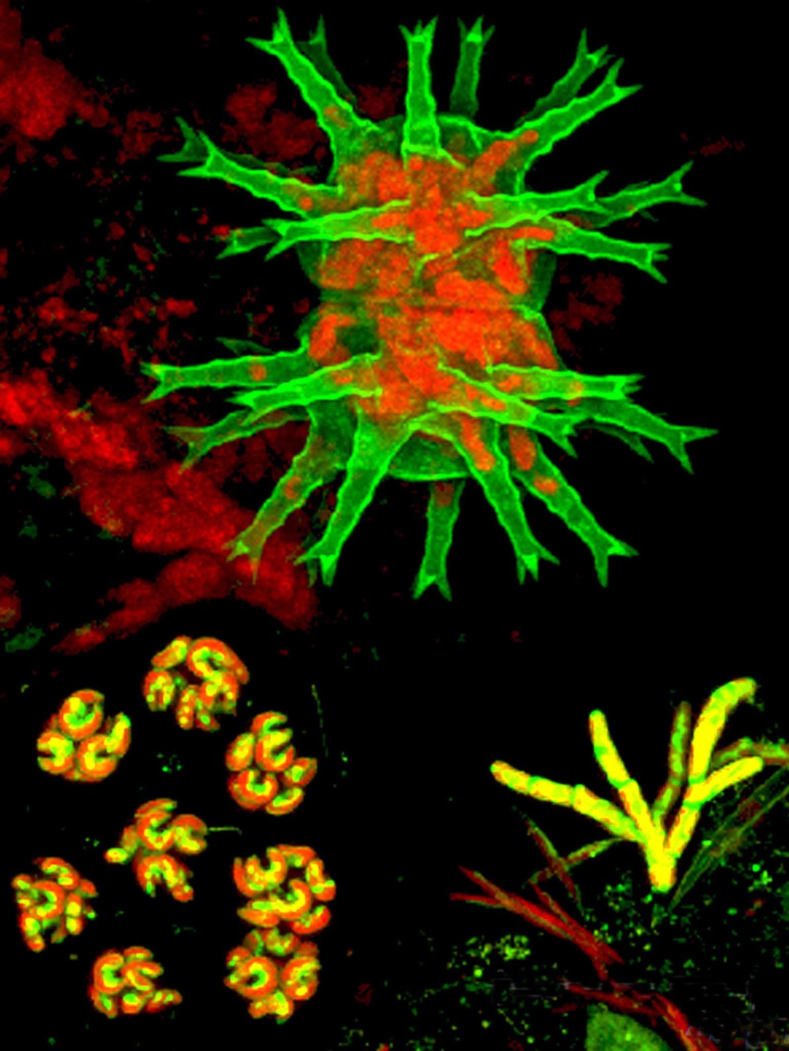Staurastrum Kirchneriella Akistrodesmus and Microthamnion | Nikon Small ...