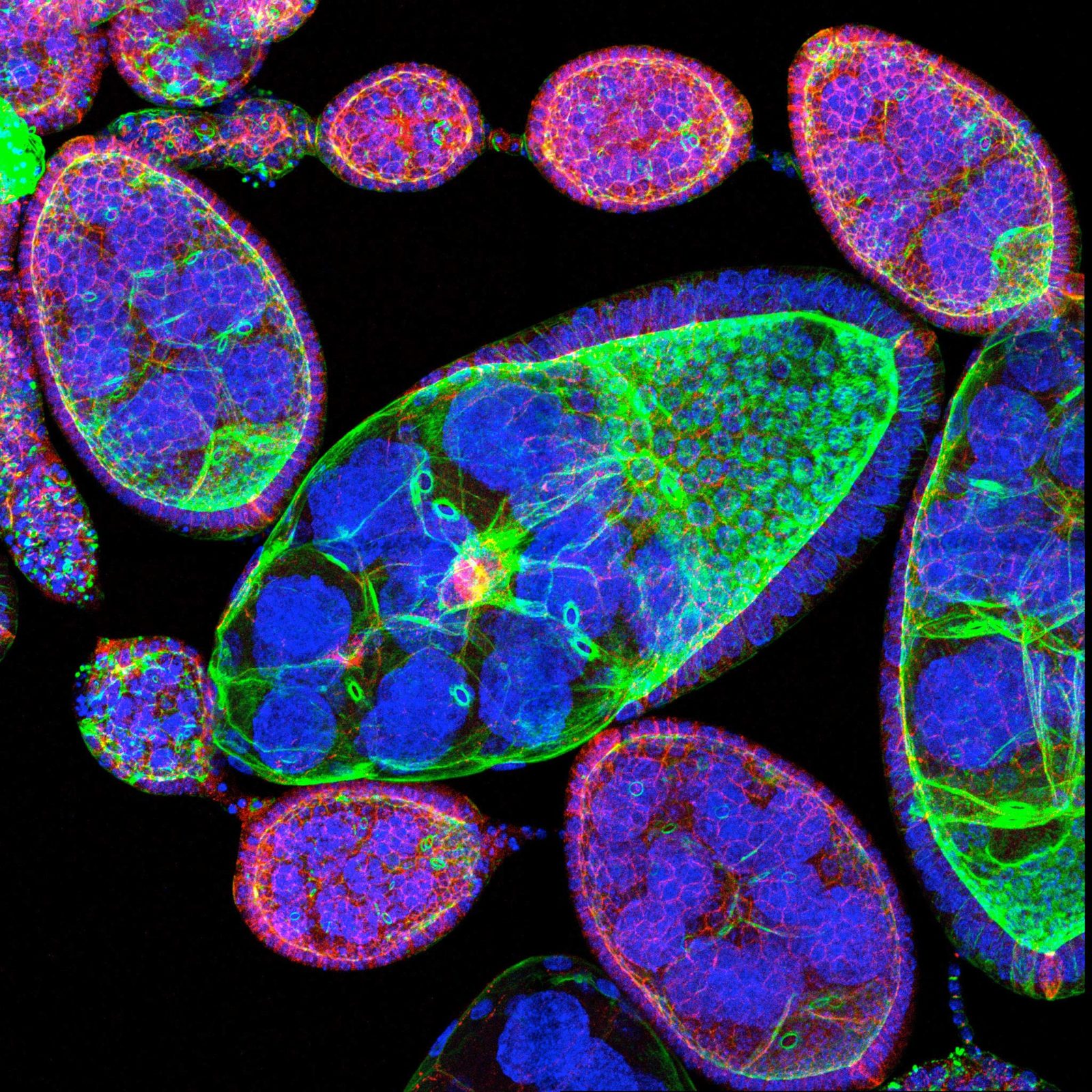 Drosophila melanogaster egg chambers | Nikon Small World