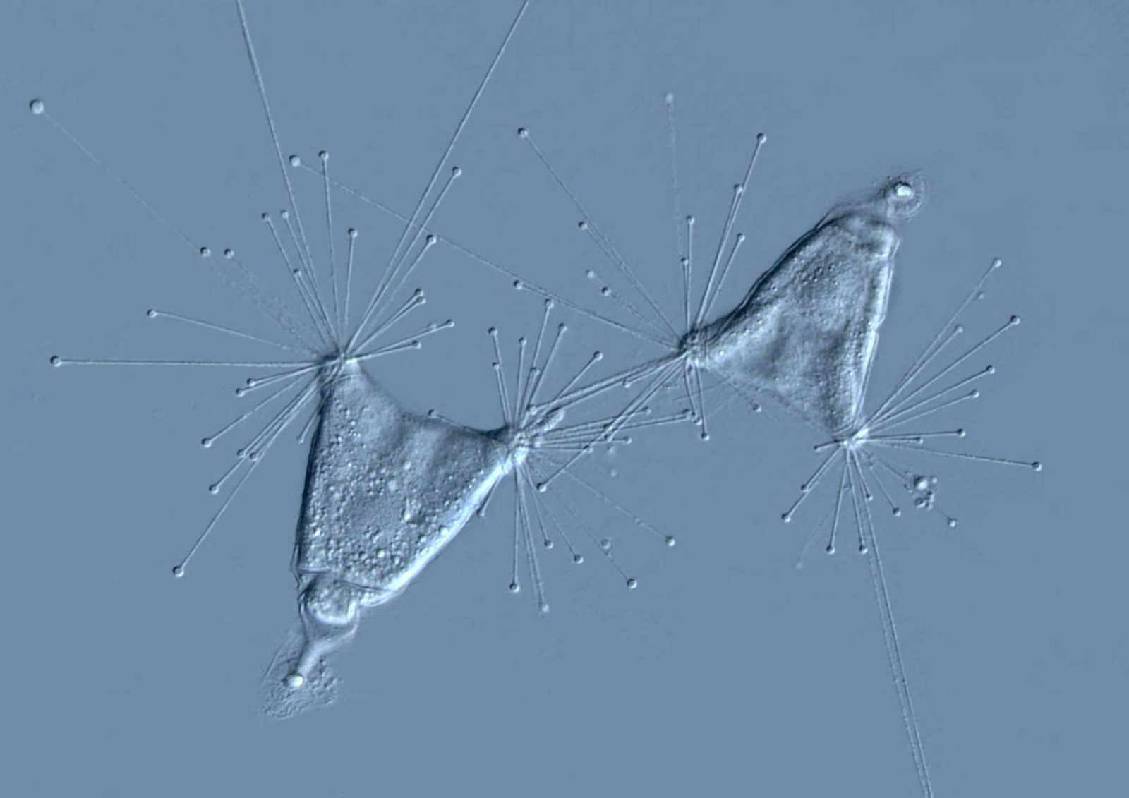 Acineta tuberosa (a suctorian ciliate, Phylum Ciliophora) | Nikon Small ...