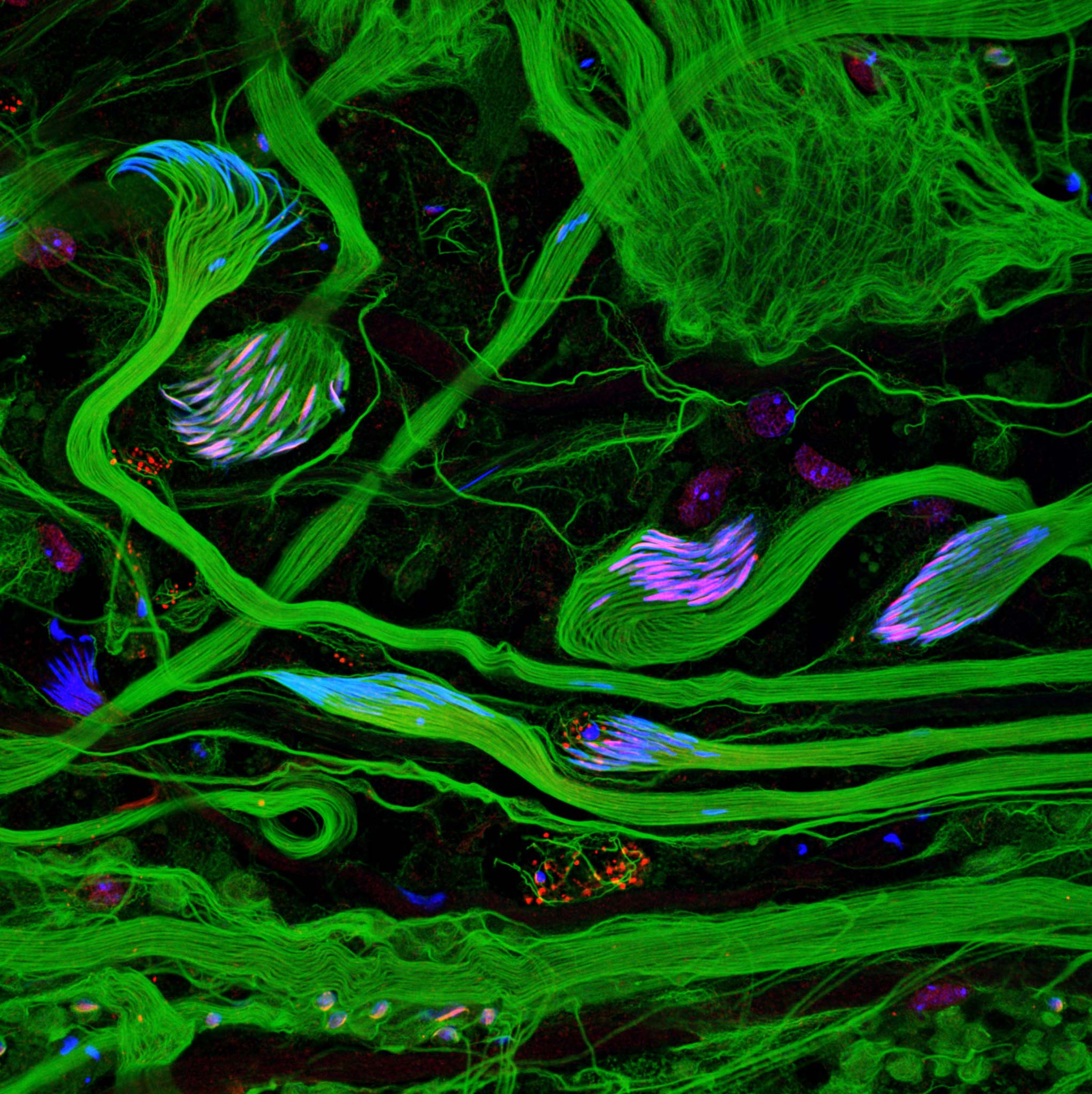 Drosophila (fruit fly) sperm | Nikon Small World