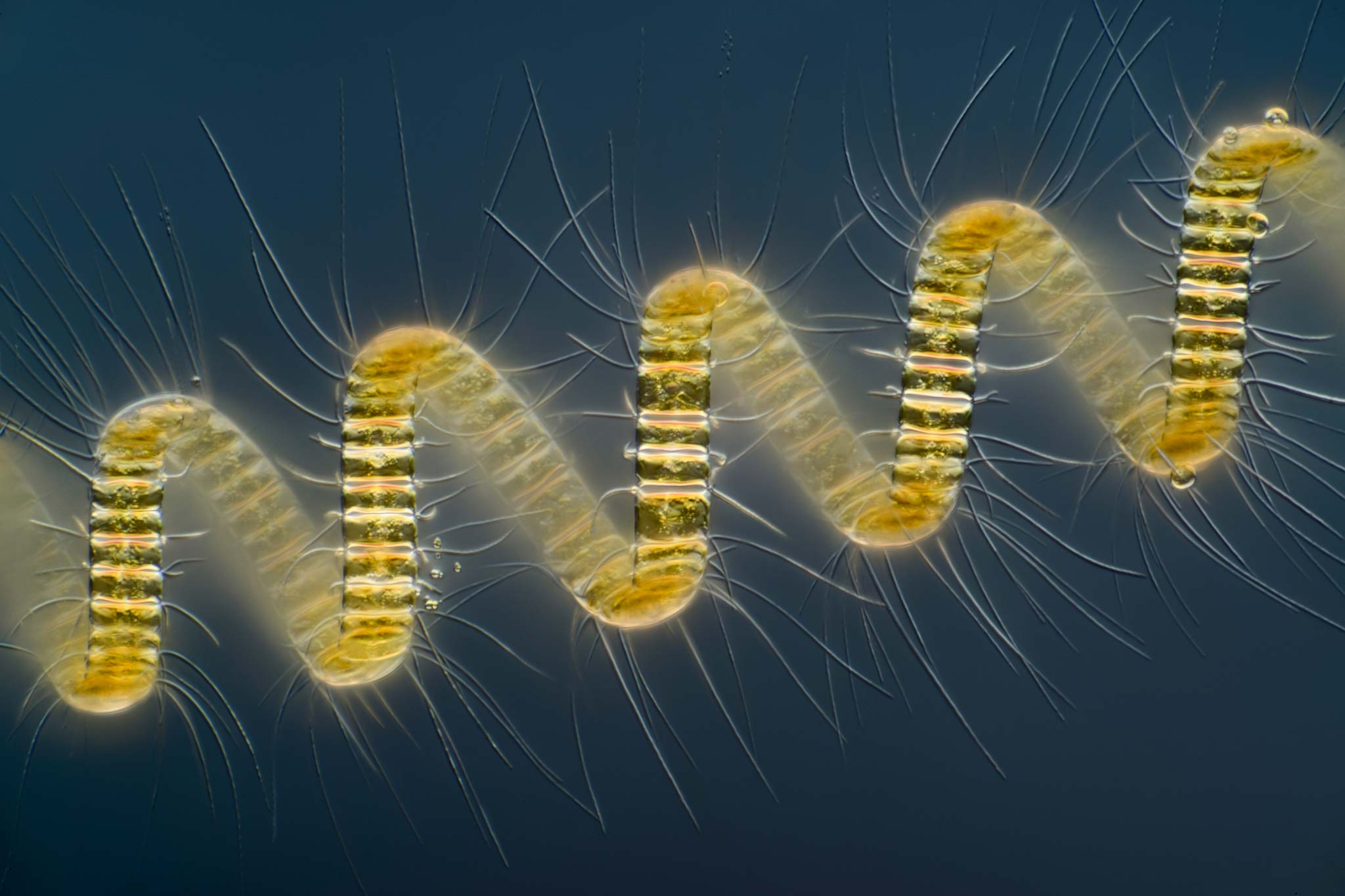 Chaetoceros debilis (marine diatom), a colonial plankton organism ...