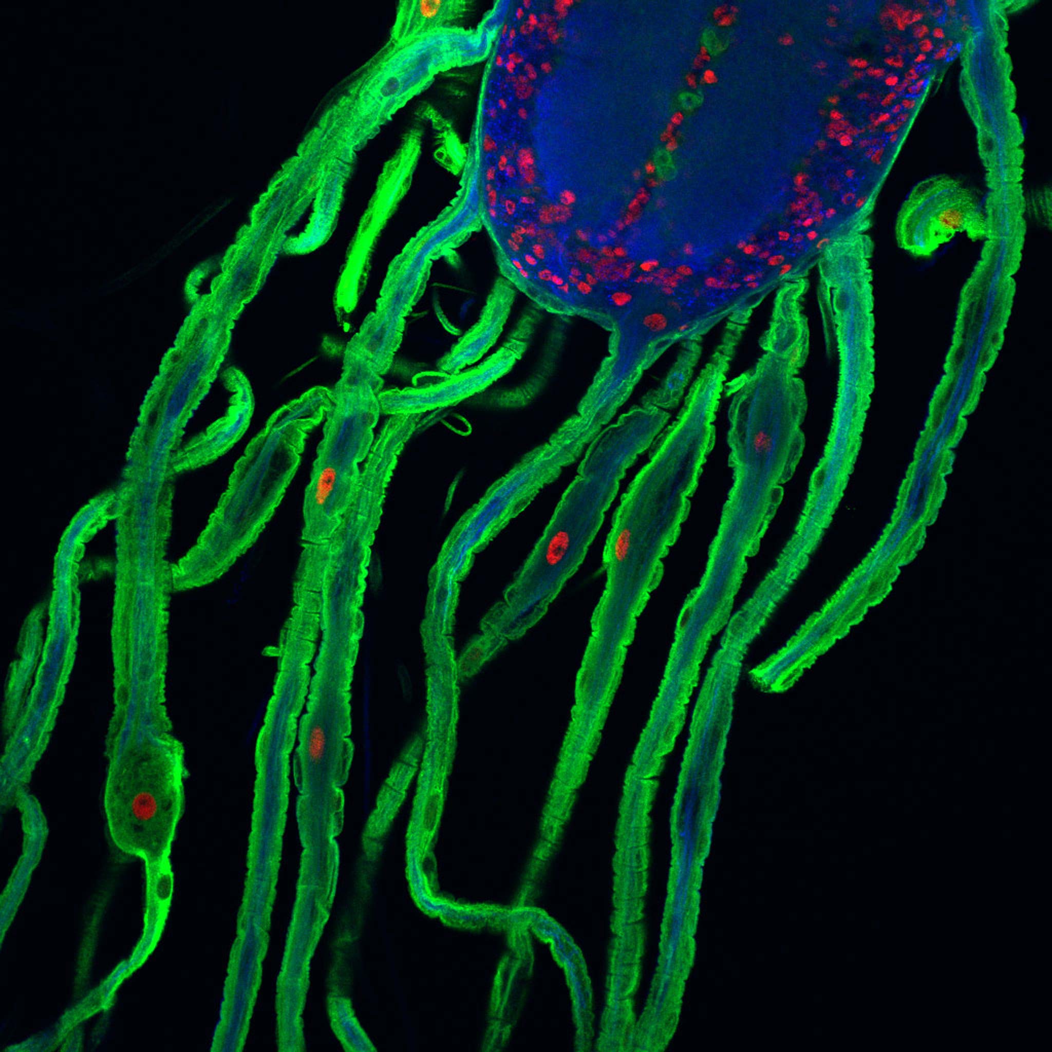 Drosophila sp. (fruit fly) larval brain | Nikon Small World