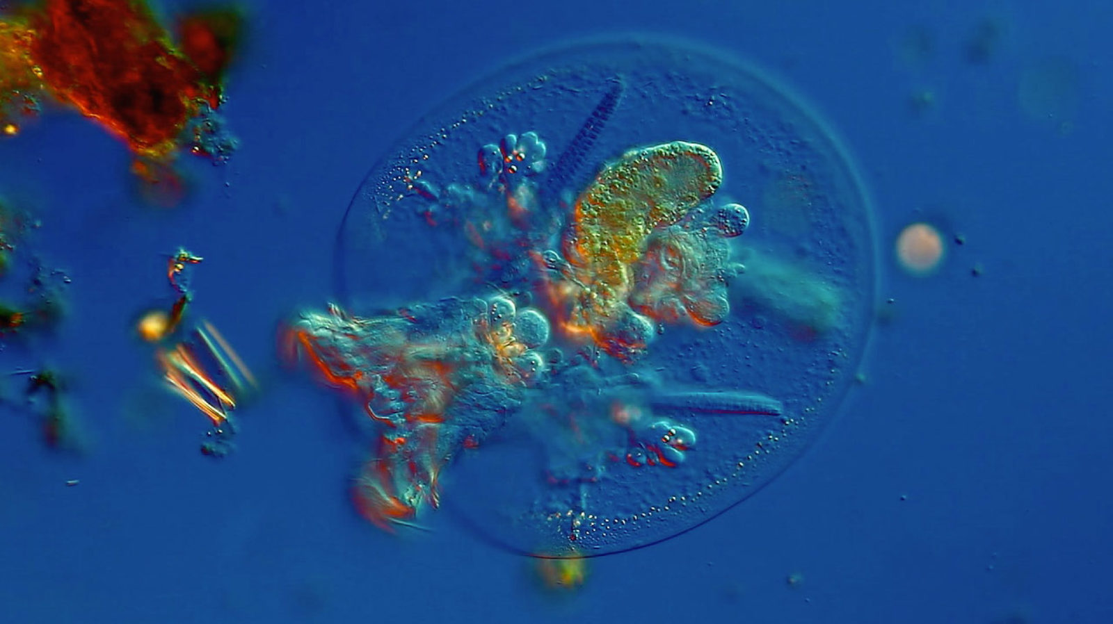 Rotifer (Testudinella) | Nikon Small World