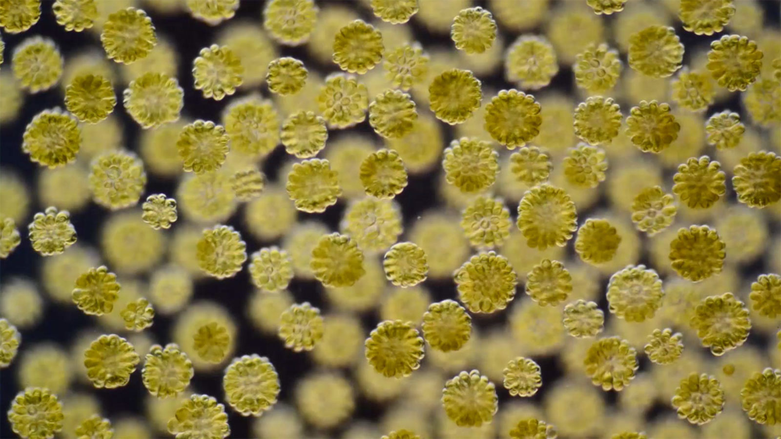 Colonial chrysophytes, Synura uvella | Nikon Small World