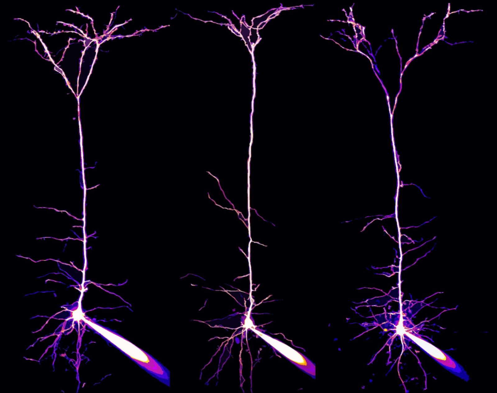 Pyramidal neurons and their dendrites visualized in the visual cortex ...