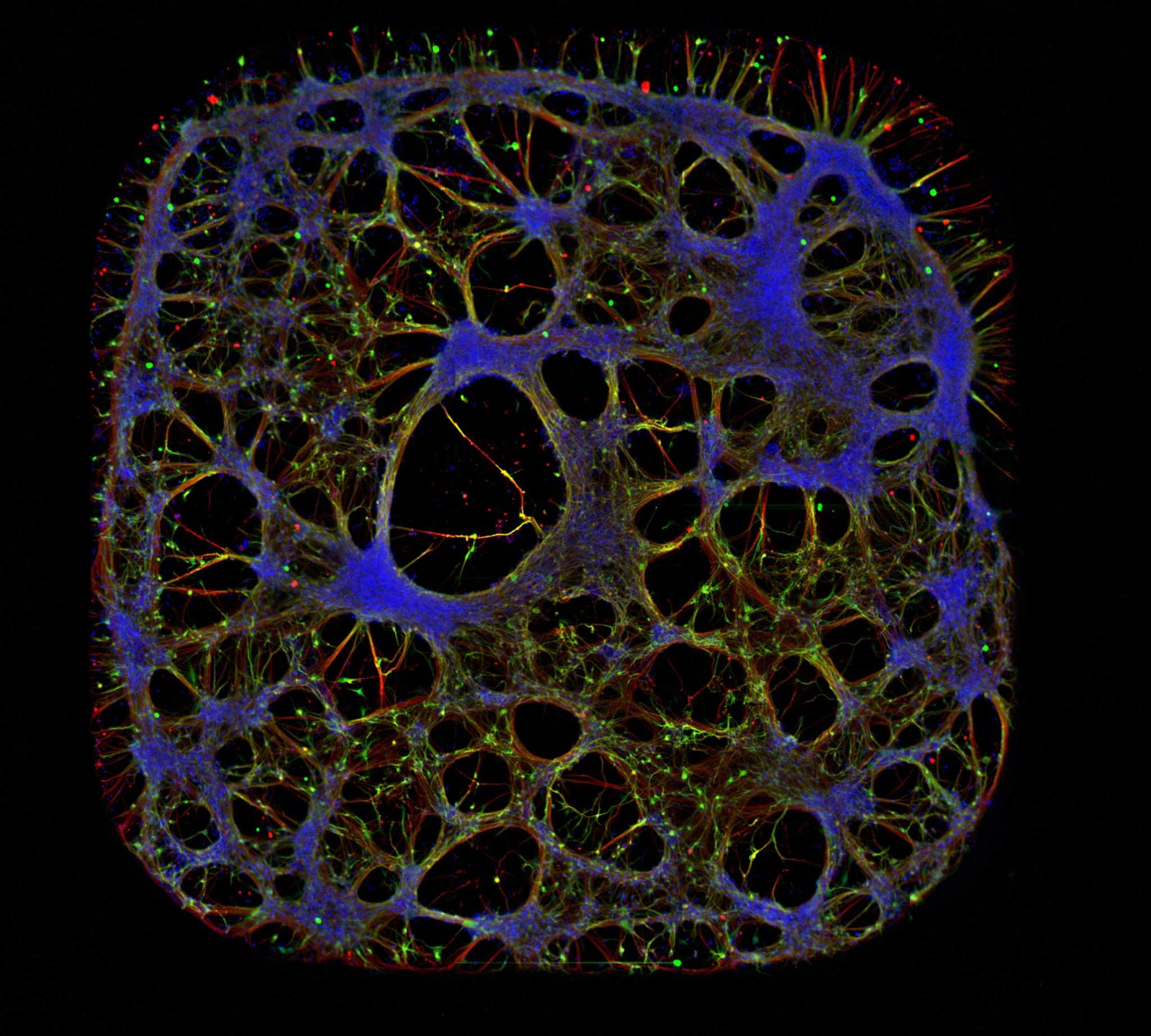 Neuroprecursor stem cells undergoing neuronal differentiation | Nikon ...