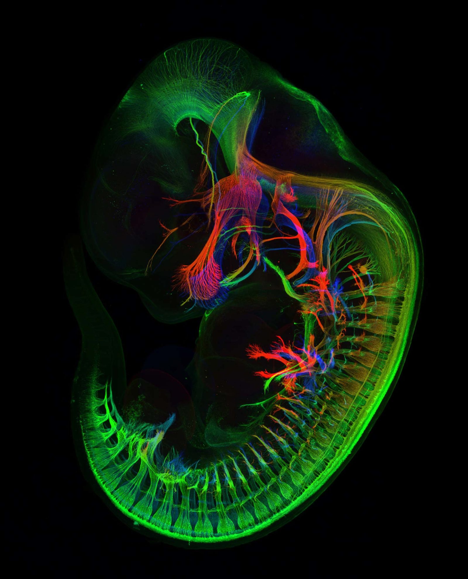 Peripheral nerves in E11.5 mouse embryo | Nikon Small World
