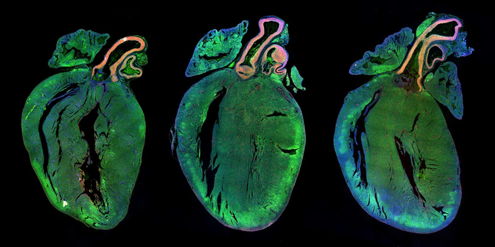 Rat heart sections | Nikon Small World