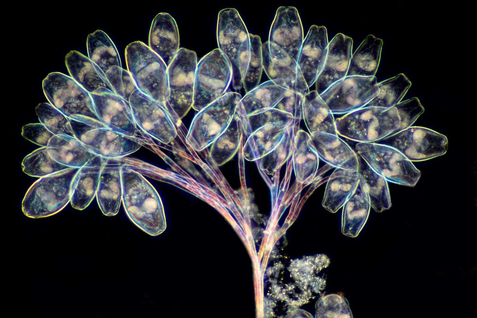 Vorticella sp. (protozoa) | Nikon Small World