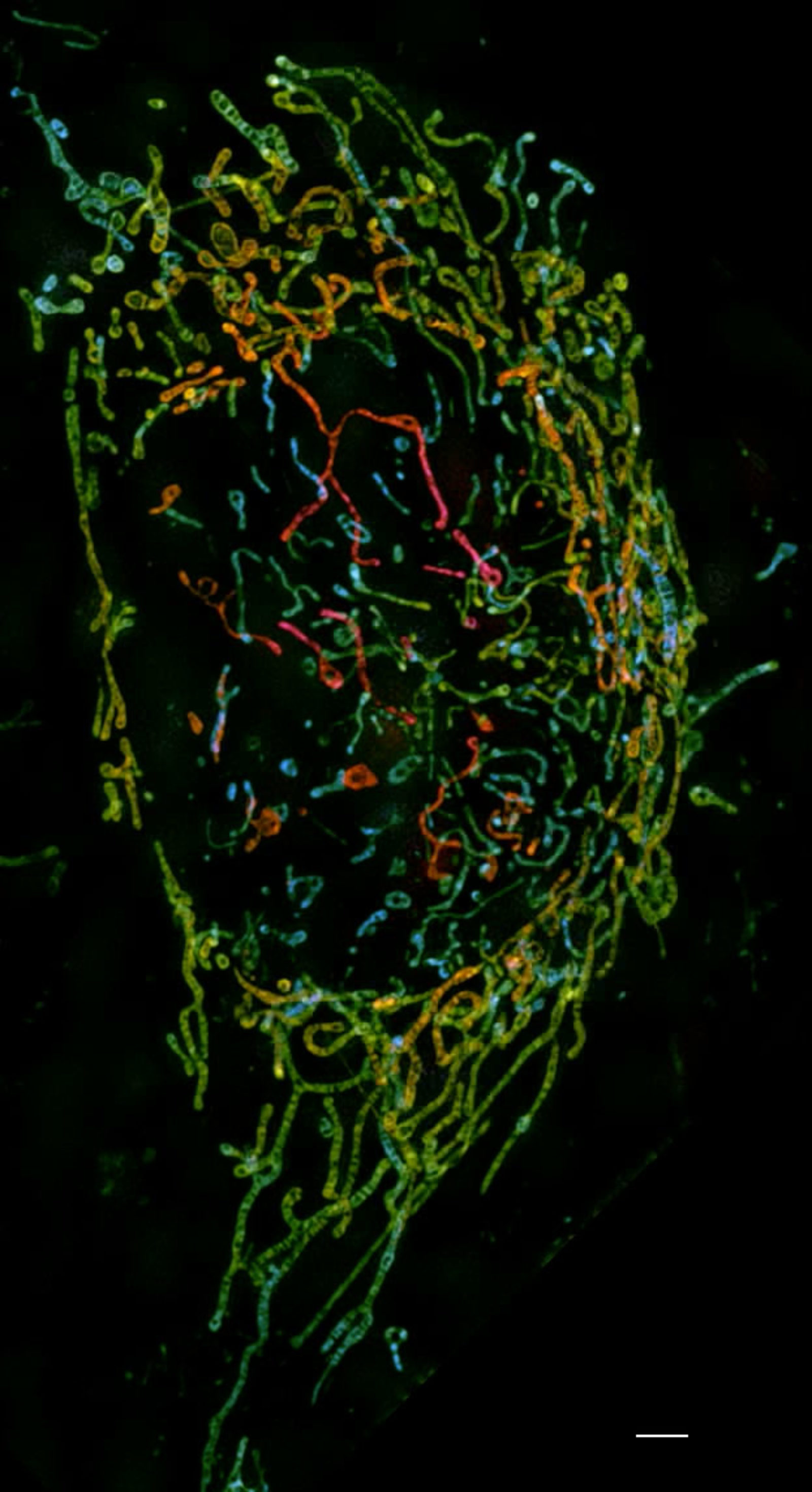 Structured Illumination Microscopy | Techniques | Nikon Small World Structured Illumination Microscopy | Techniques | Nikon Small World