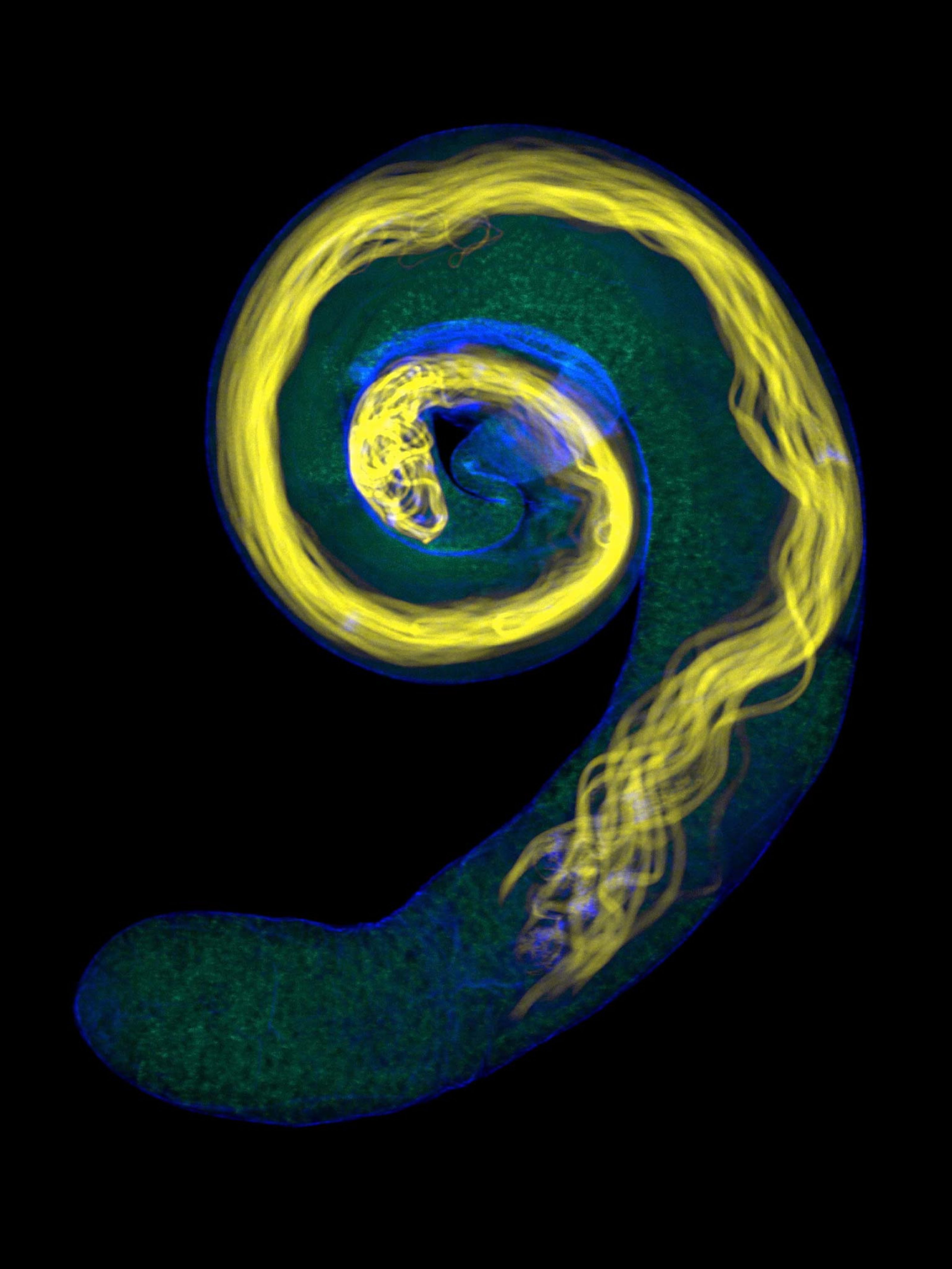 Male Drosophila melanogaster (fruit fly) spiral shaped testis | Nikon ...