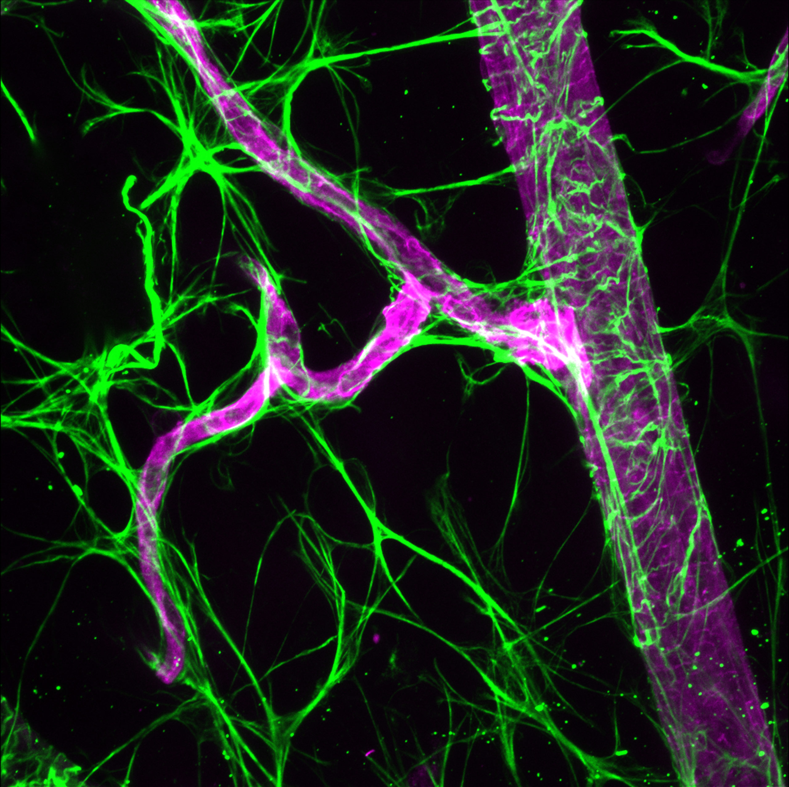 Image of a mouse retina showing astrocytes and blood vessel | Nikon ...