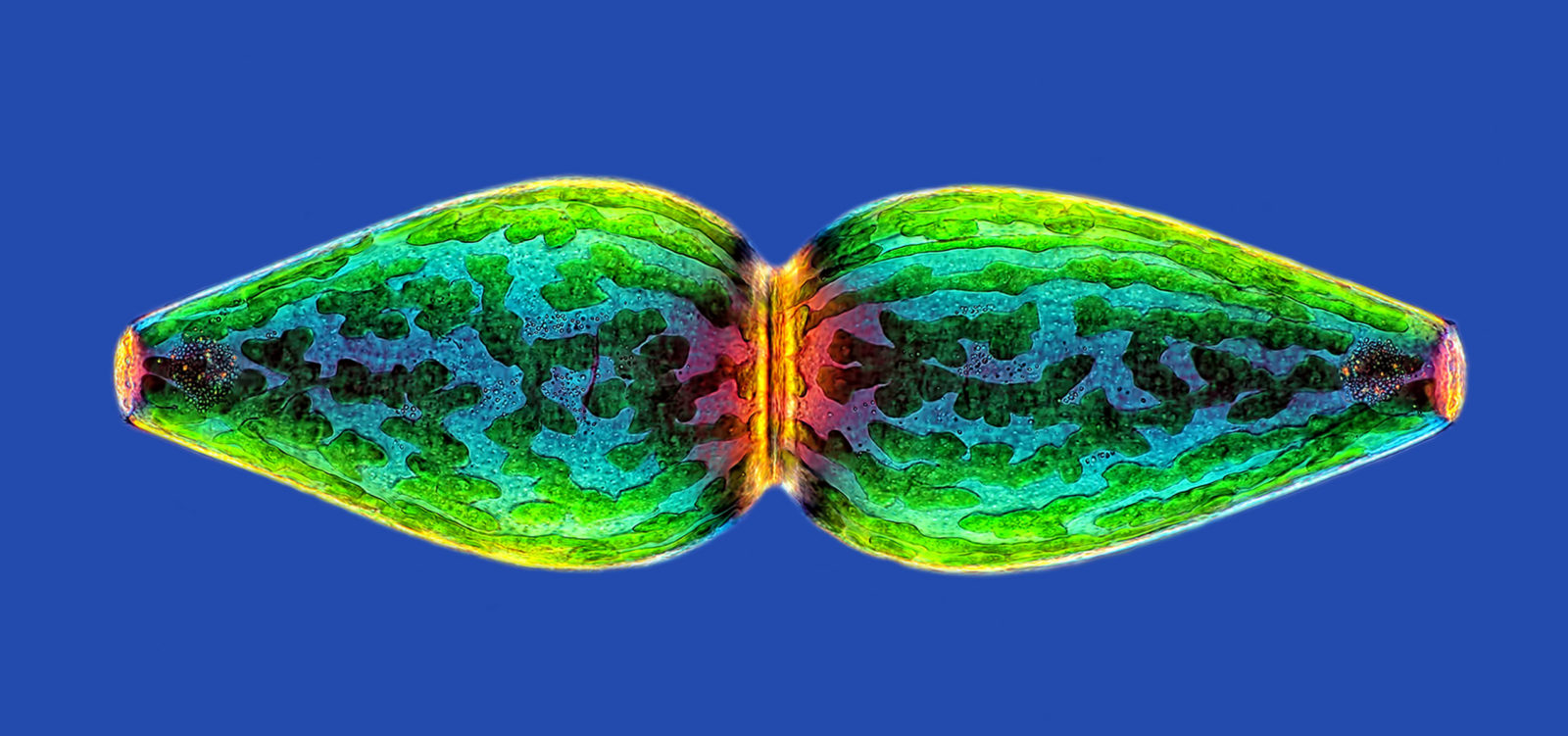 Pleurotaenium ovatum (microalgae) | Nikon Small World