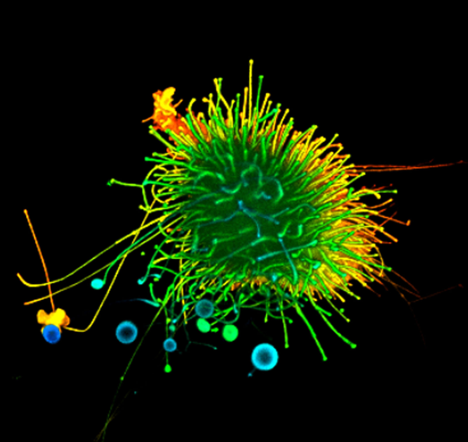 Live cultured human mesothelial cell activated to produce hyaluronan ...