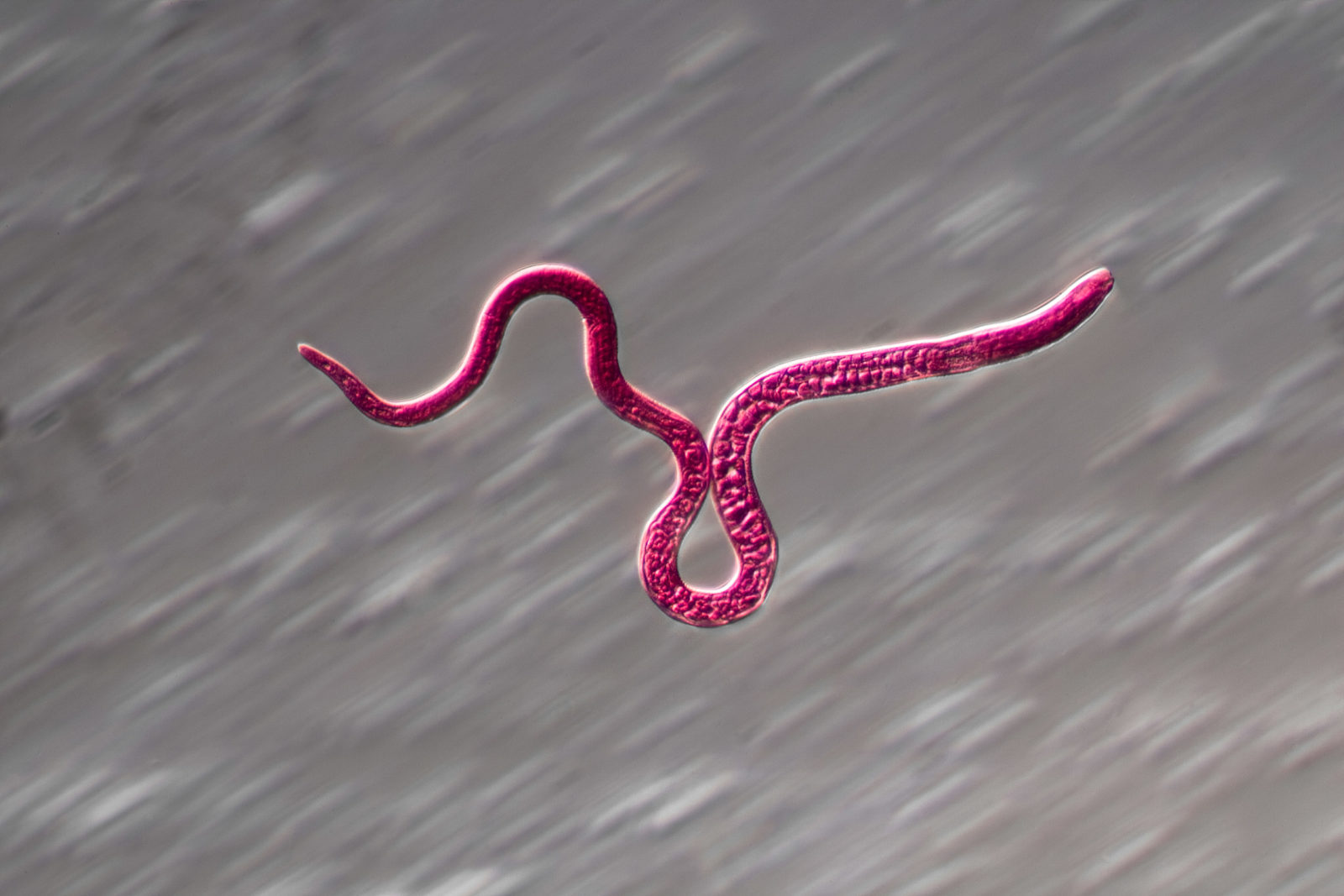 Trichinella worm | Nikon Small World