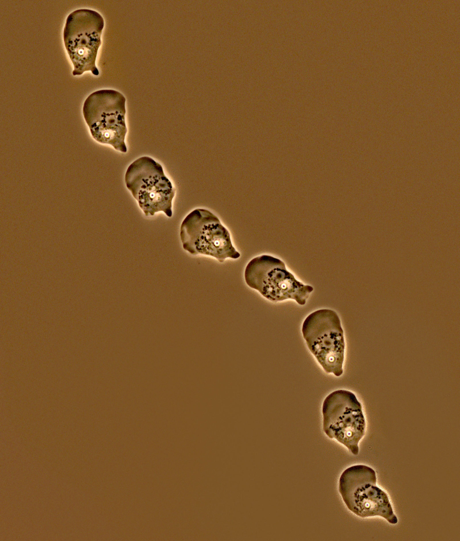 Single, live amoeba tracked as it crawls along a slide | Nikon Small World