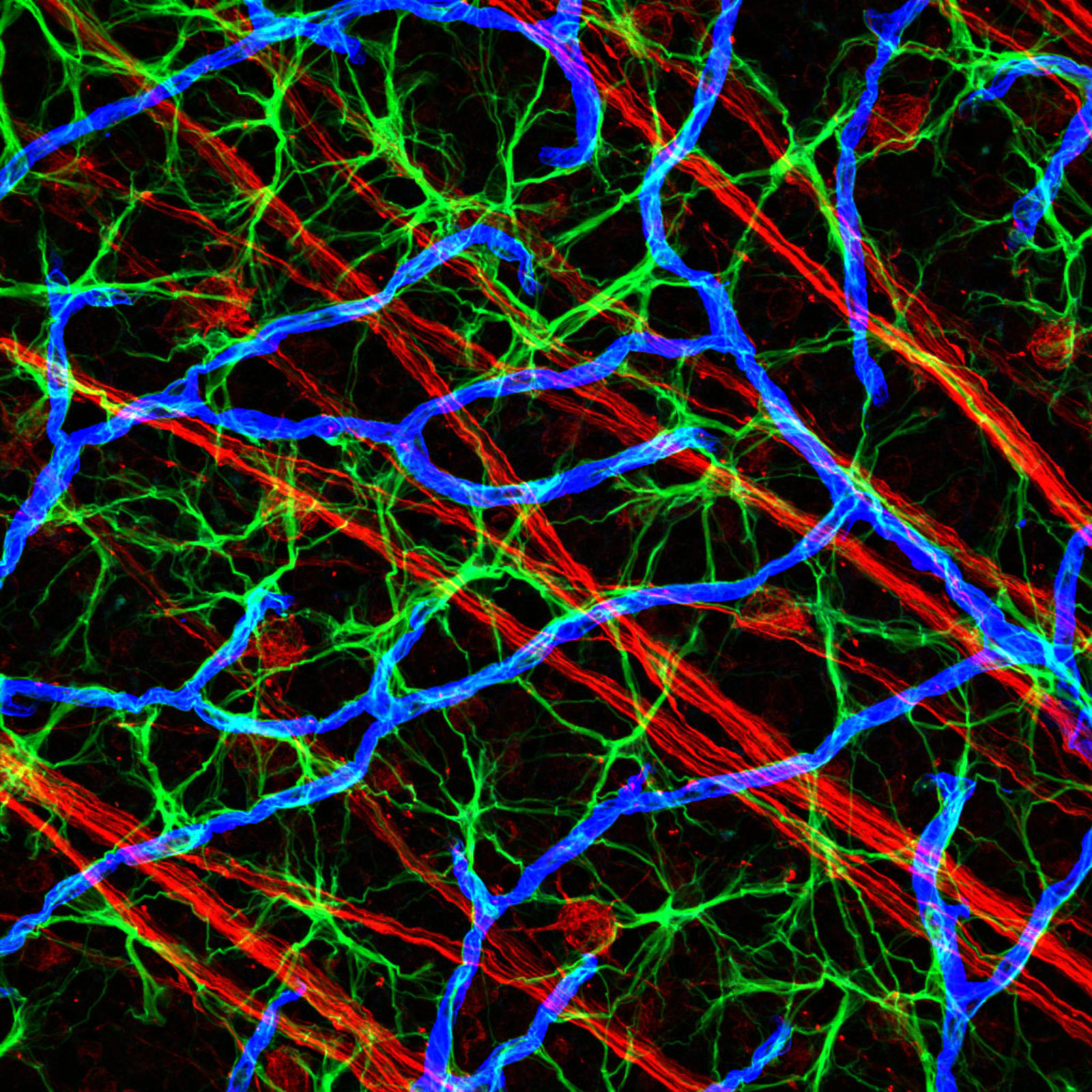 Retinal whole mount, showing ganglion cell bodies and their axon ...