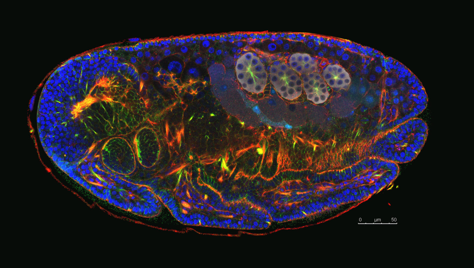 Pea aphid embryo | Nikon Small World