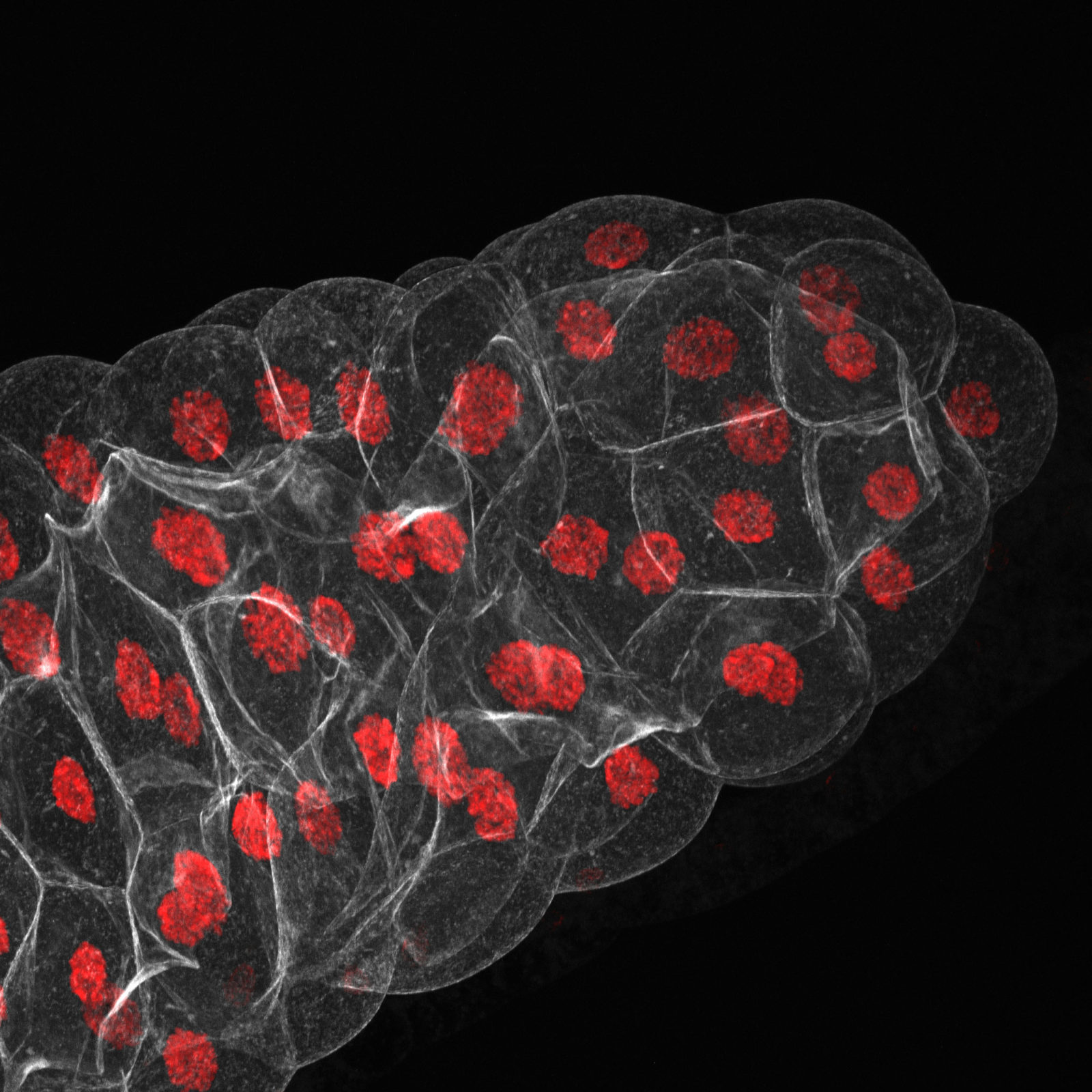 Salivary gland cells from a fruit fly showing cell boundaries and ...