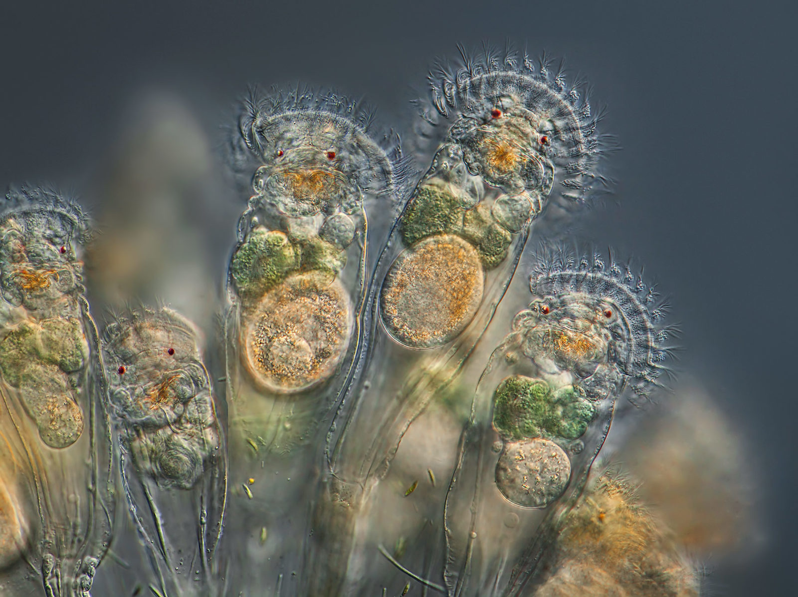 Conochilus unicornis (rotifer), actively feeding | Nikon Small World