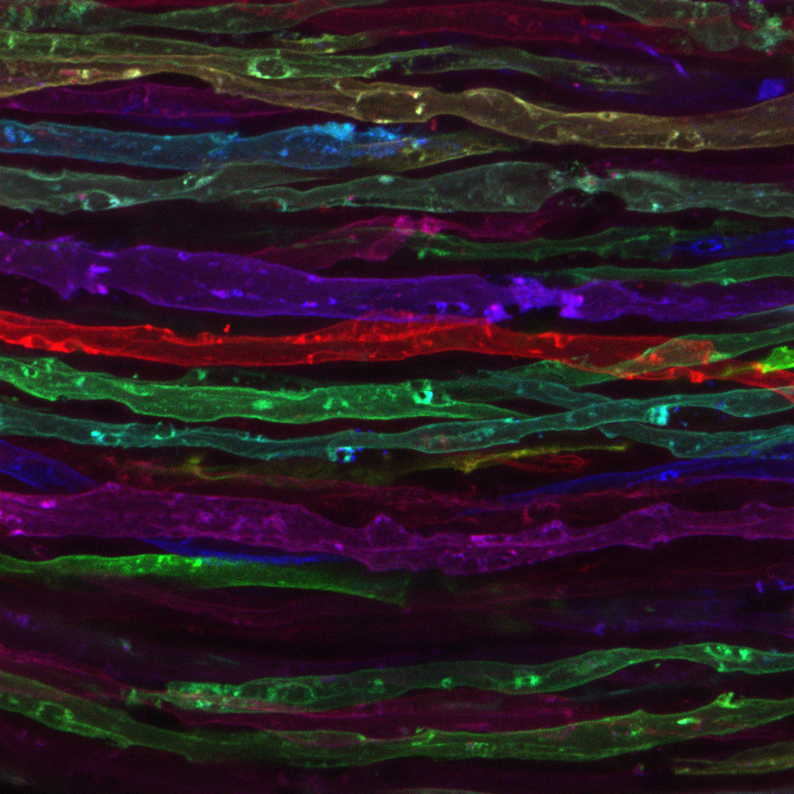 Oculomotor nerve of a transgenic Brainbow mouse | Nikon Small World